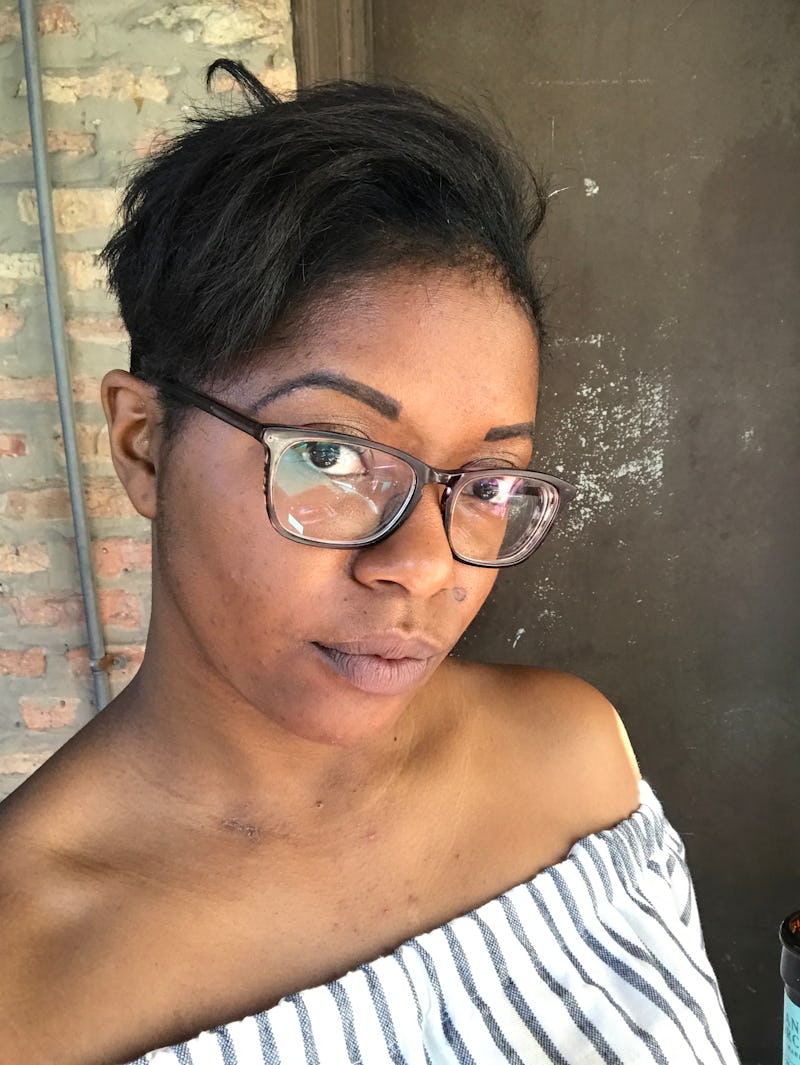 How An Accidental Pixie Cut Helped Me To Finally Embrace My 4C Curls