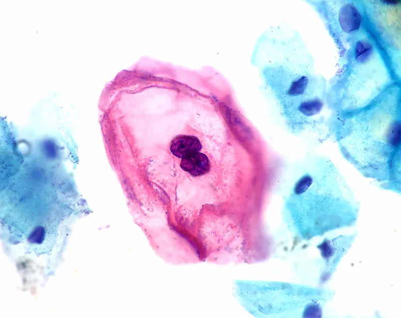 The HPV guide for men