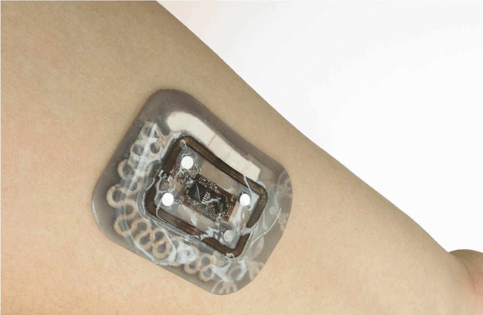 Wearable device slurps sweat to detect crucial health information