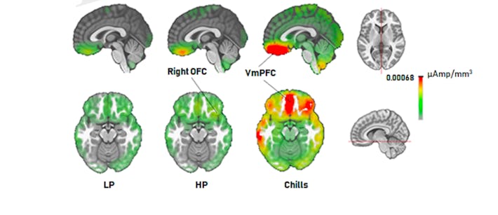 Brain study pinpoints why music can literally give you the chills