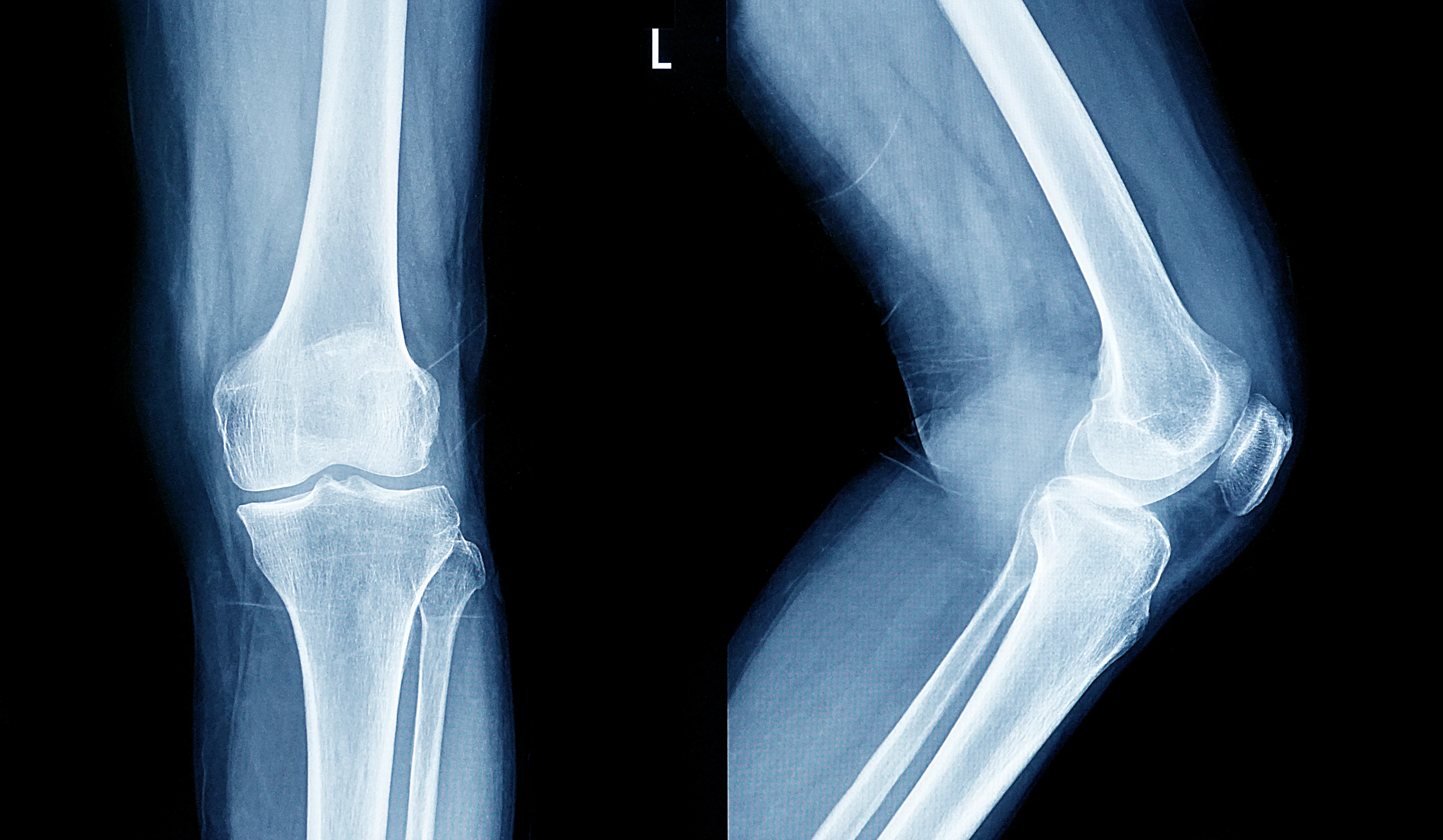 Batteries inspired by bones could finally topple lithium