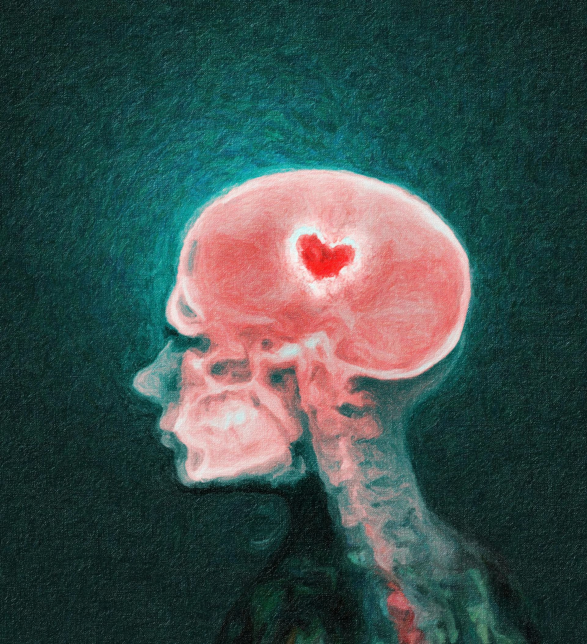 Brain scans show the secret to maintaining long-term love