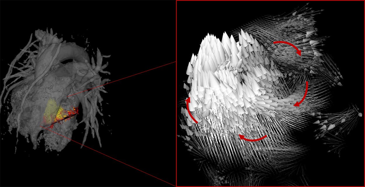 4D images reveal men and women have key differences in 1 vital organ