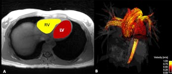 4D images reveal men and women have key differences in 1 vital organ