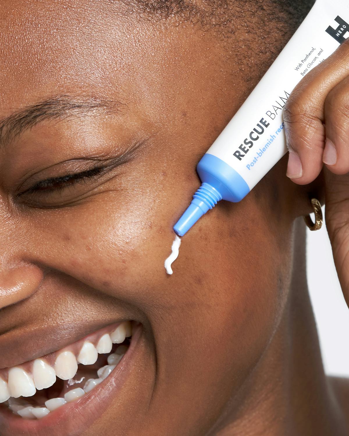 Hero Cosmetics' New Rescue Balm Is The Ideal Follow-Up To Patching Or ...