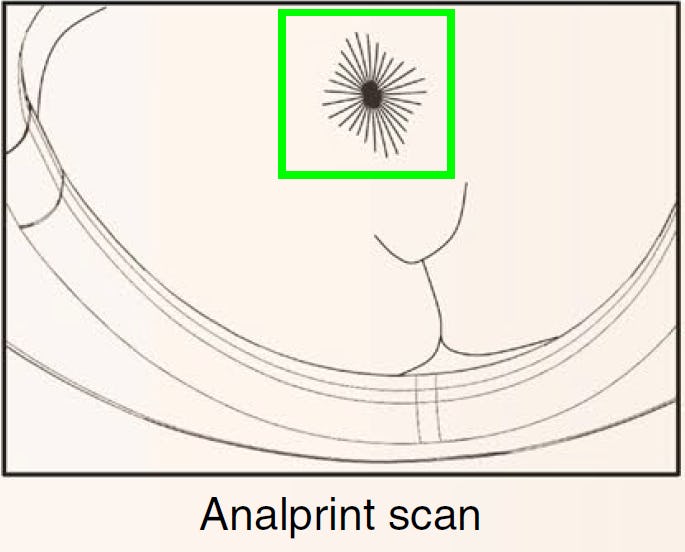 This smart toilet wants to film you -- in the name of health