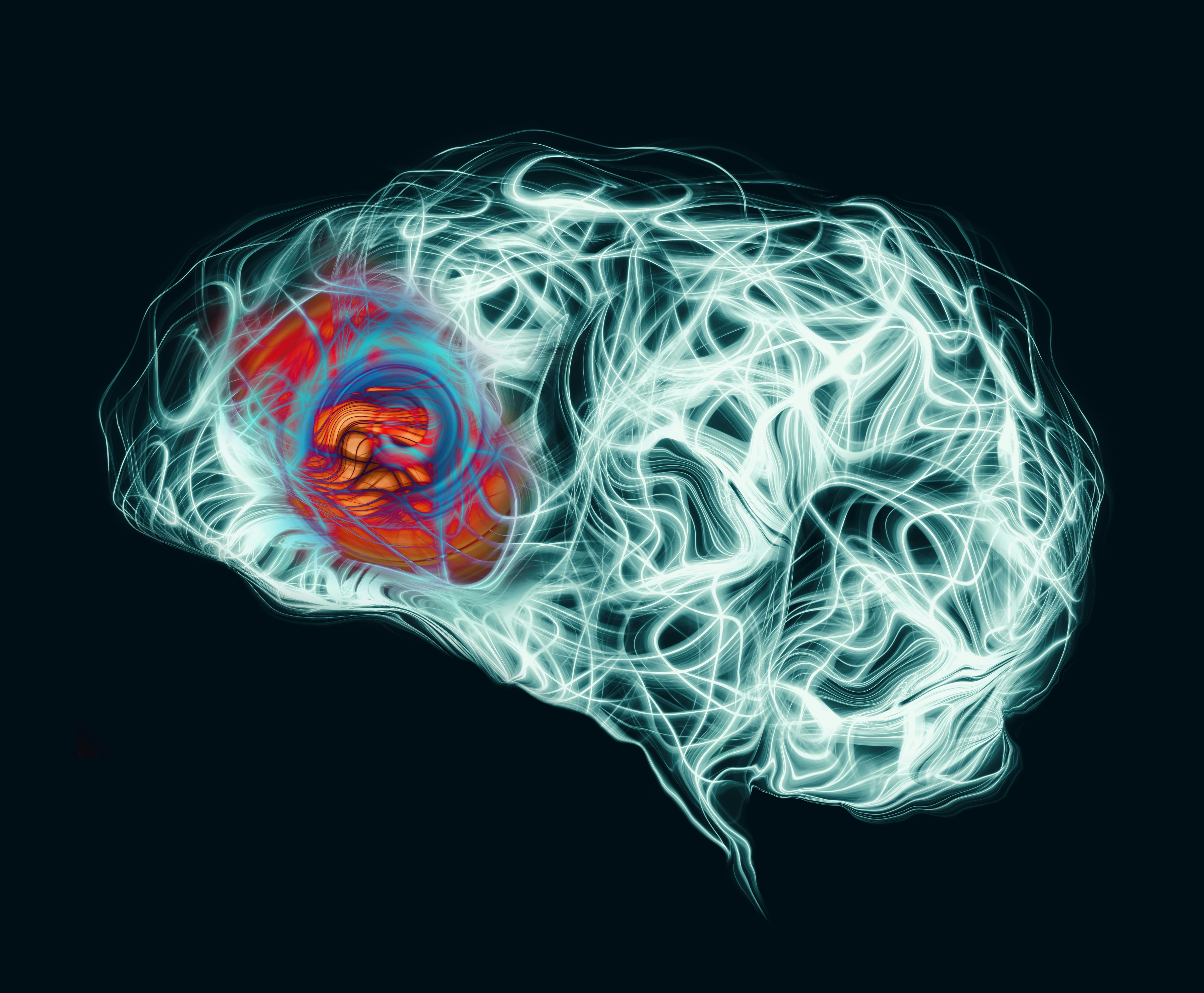 The virus that causes cold sores could trigger a devastating brain ...