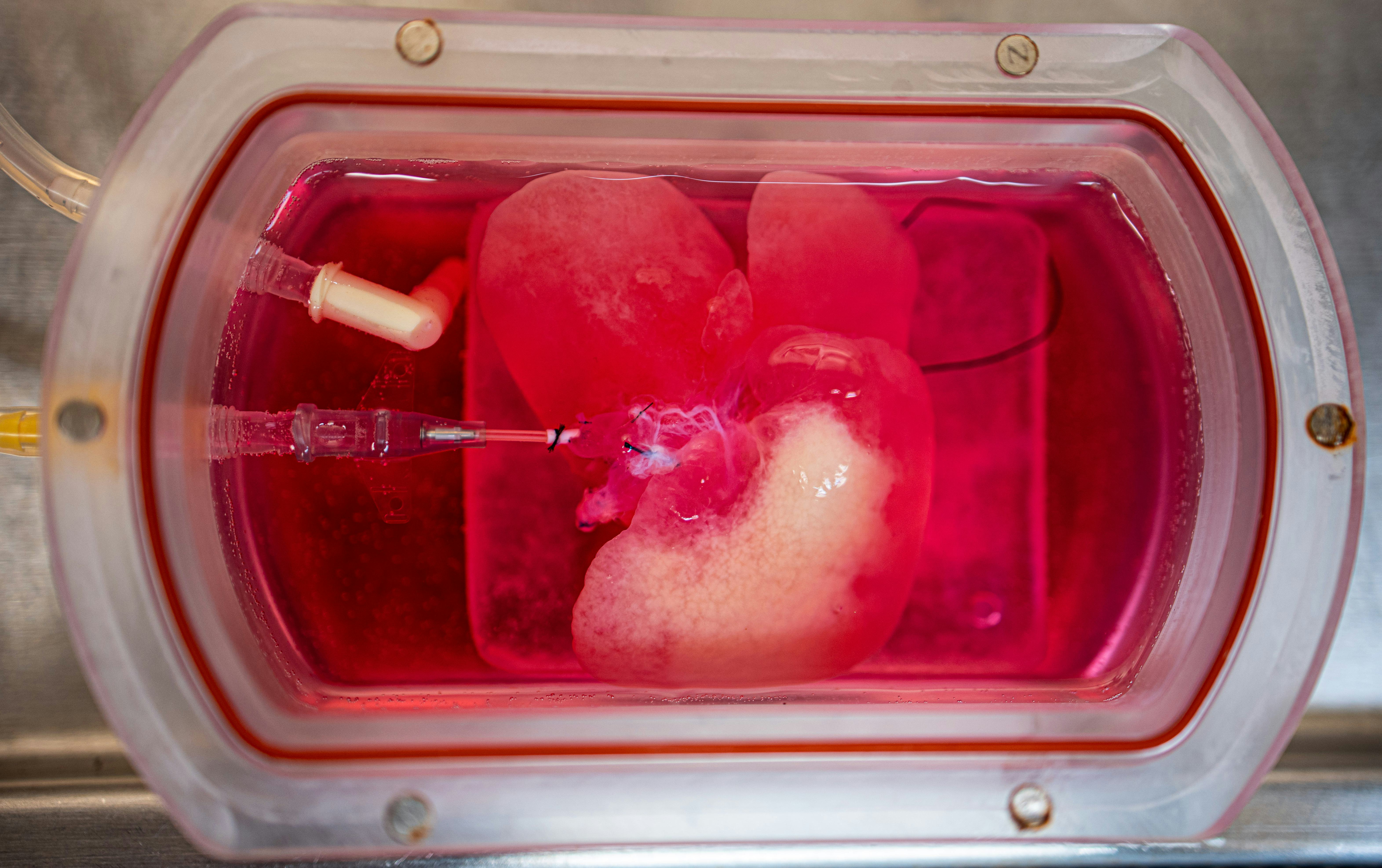 Human mini-livers pave the way for made-to-order organ transplants
