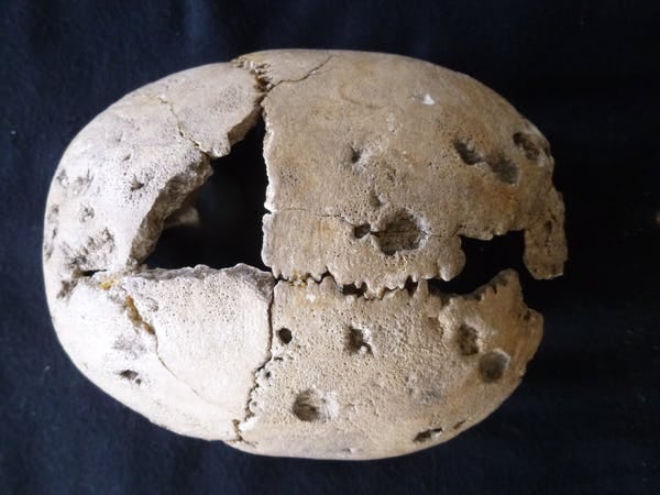 The archaeological record reveals something strange about diseases ...