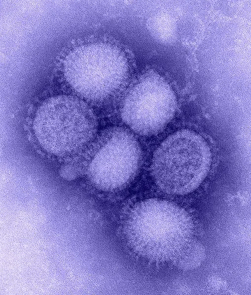 Scientists explain the new swine flu virus with pandemic potential