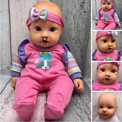 BrightEars Inclusive Dolls Feature Hearing Aids, Cleft Lips & Feeding Tubes