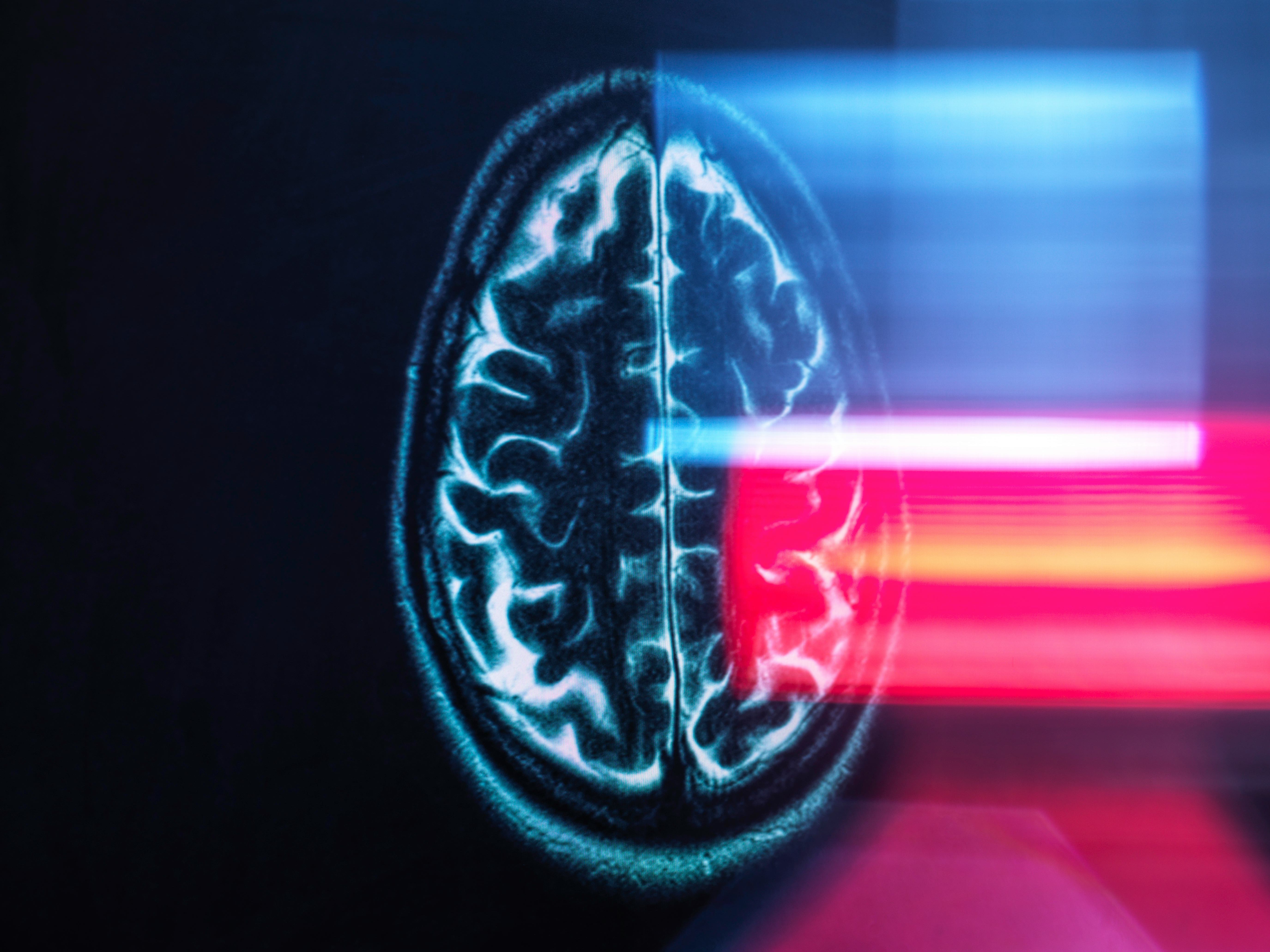 Scientists achieve a remarkable breakthrough for treatment-resistant ...