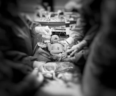 13 C-Section Facts No One Tells You Ahead Of Time