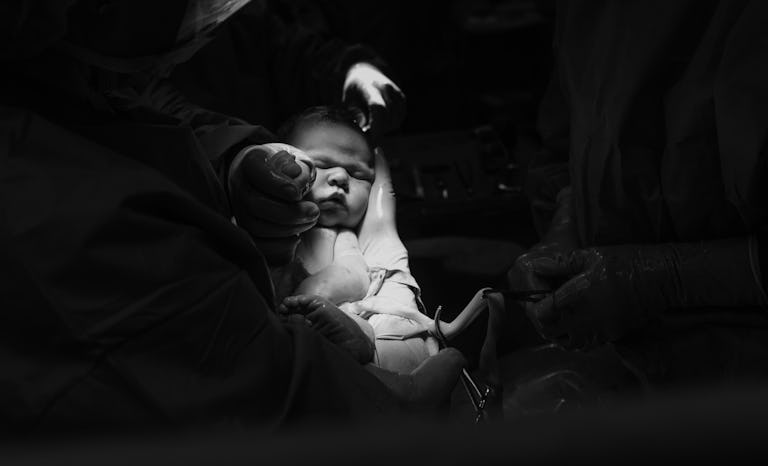 The C-Section Procedure: A Step-By-Step Guide To Surgery, According to ...