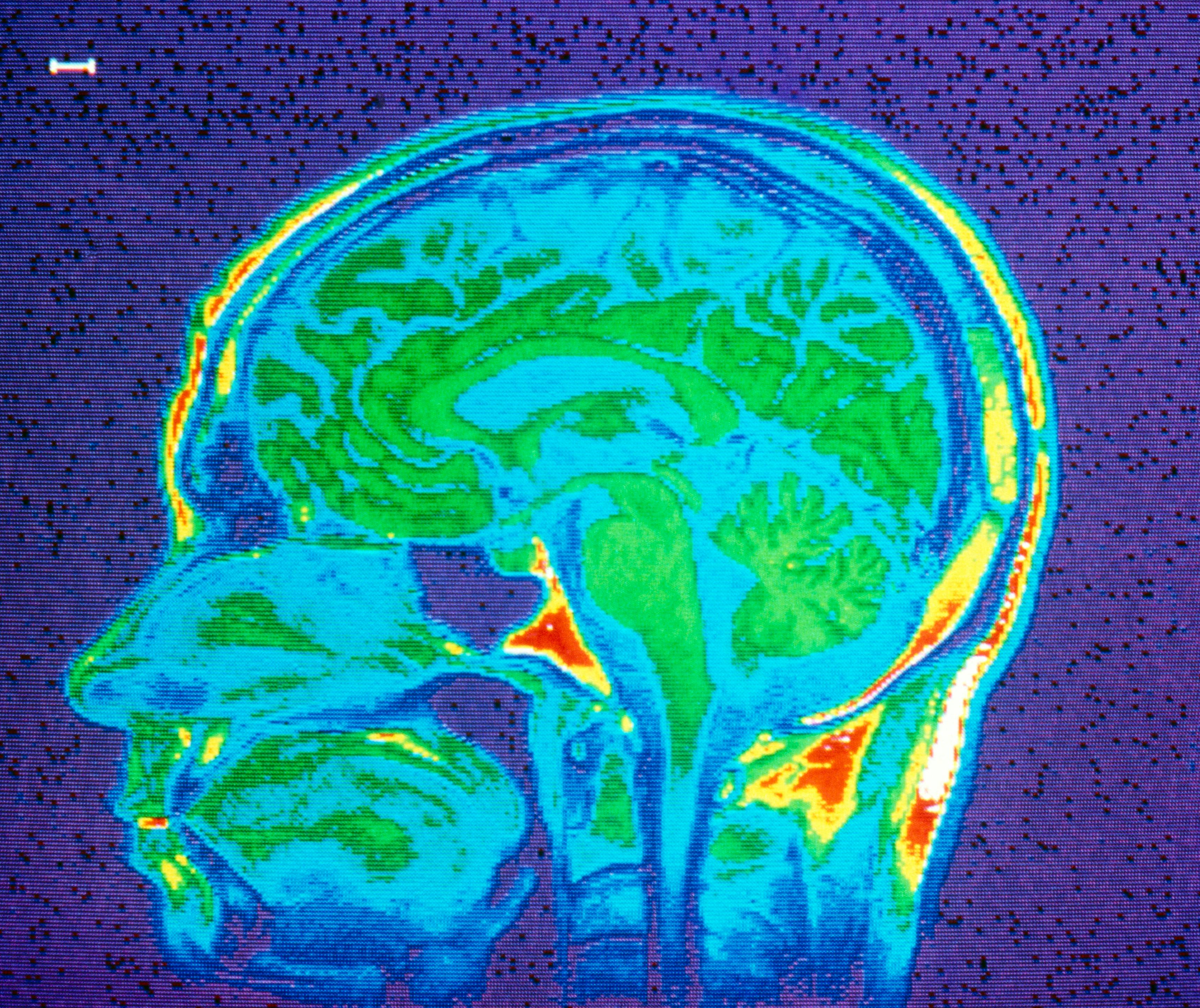 10 minutes of this accessible exercise may result in a better brain