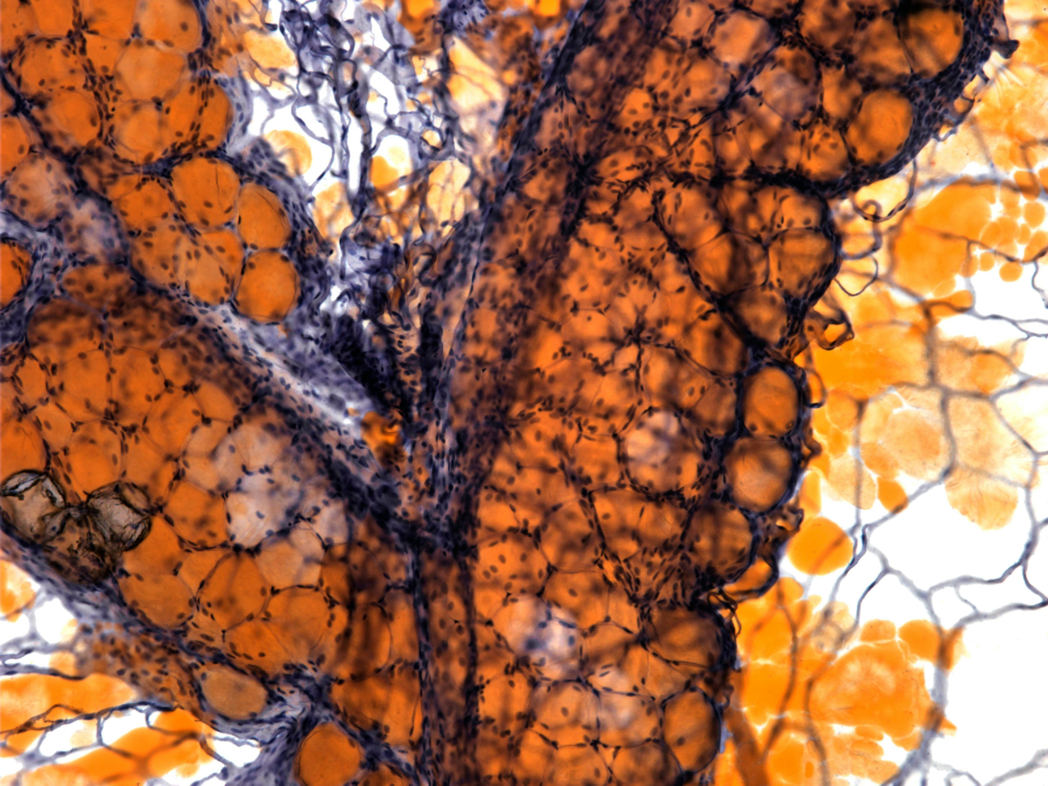 Can intermittent fasting burn fat? Experts explain the complicated truth