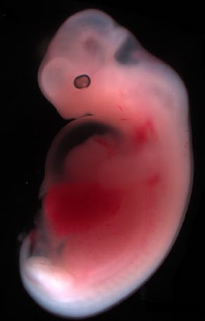 Scientists grow human muscles in pig embryos for the first time