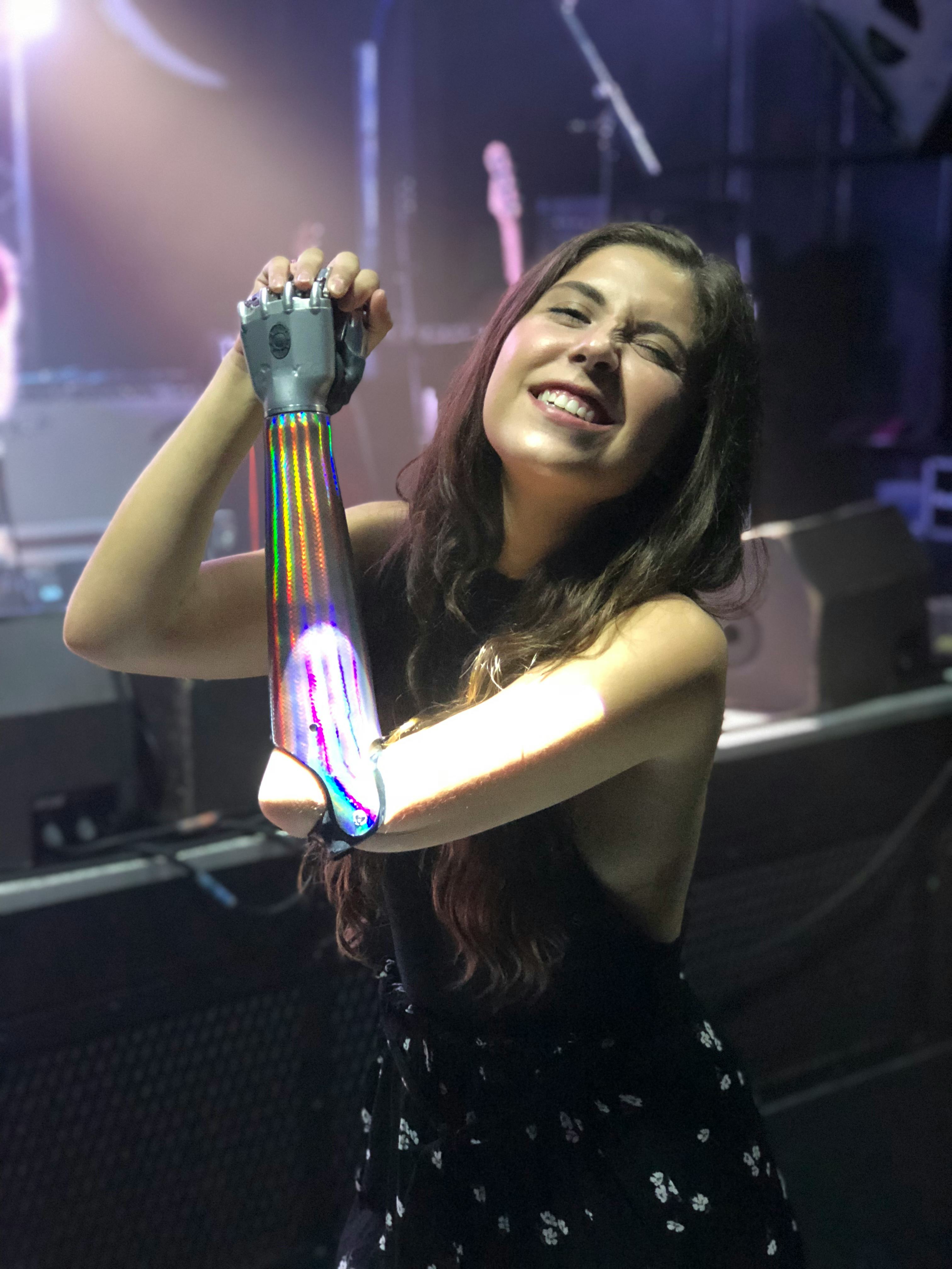 I have one of the most advanced prosthetic arms in the world — and I ...