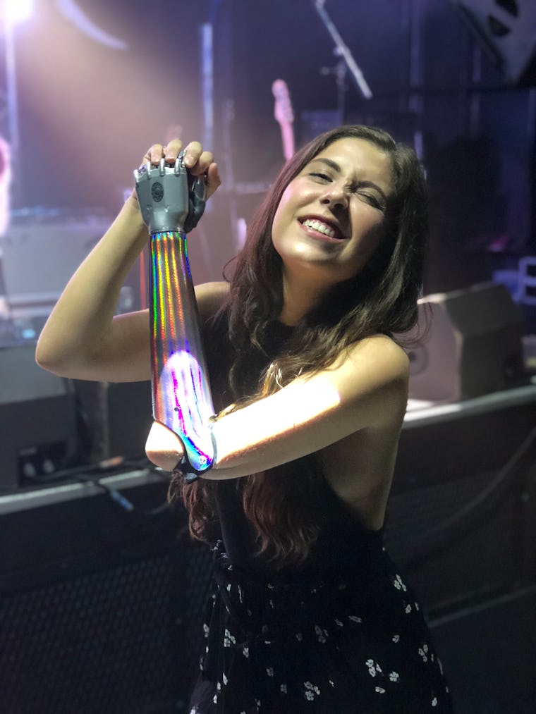 I have one of the most advanced prosthetic arms in the world — and I ...