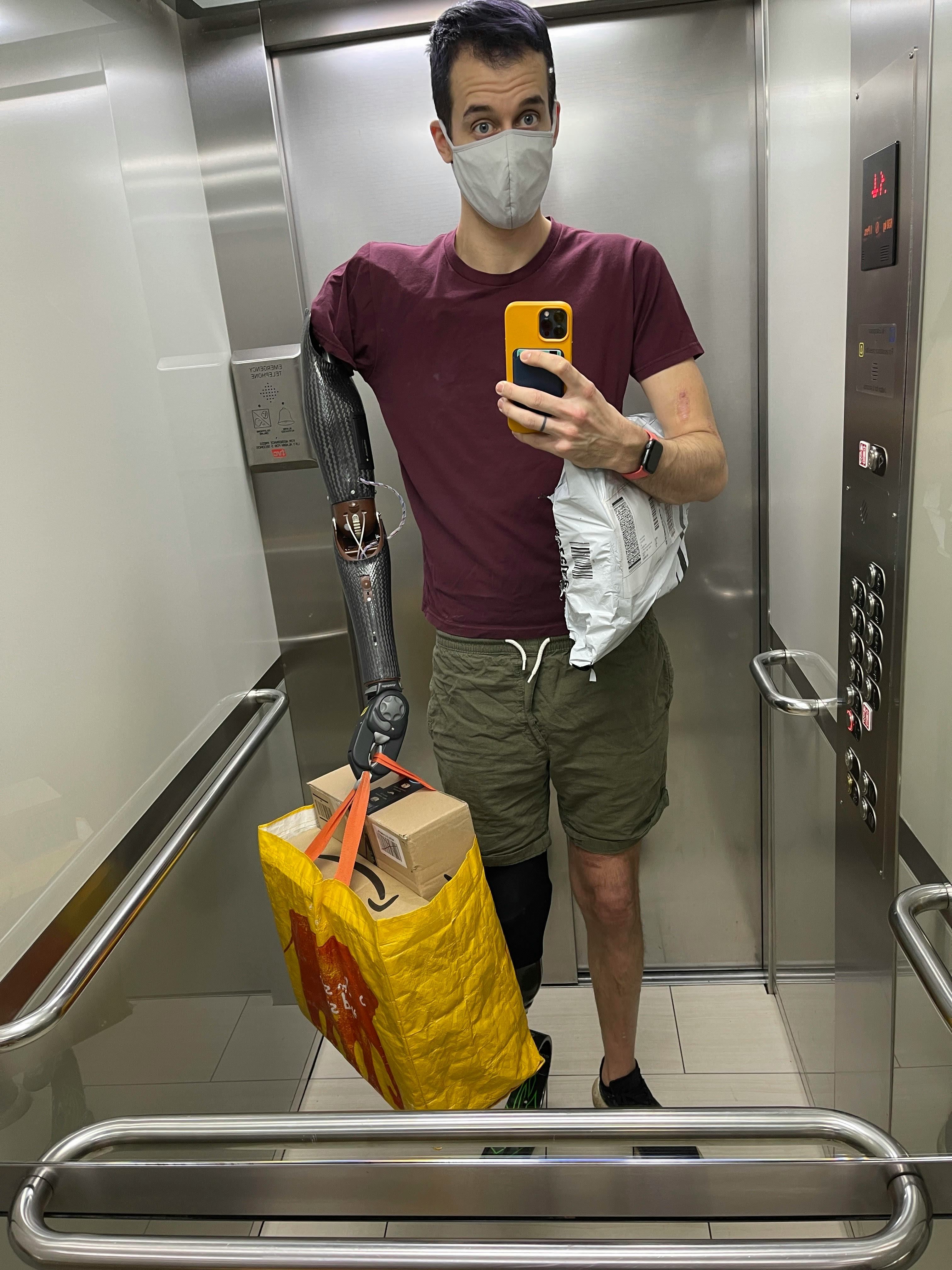 I have one of the most advanced prosthetic arms in the world — and I ...