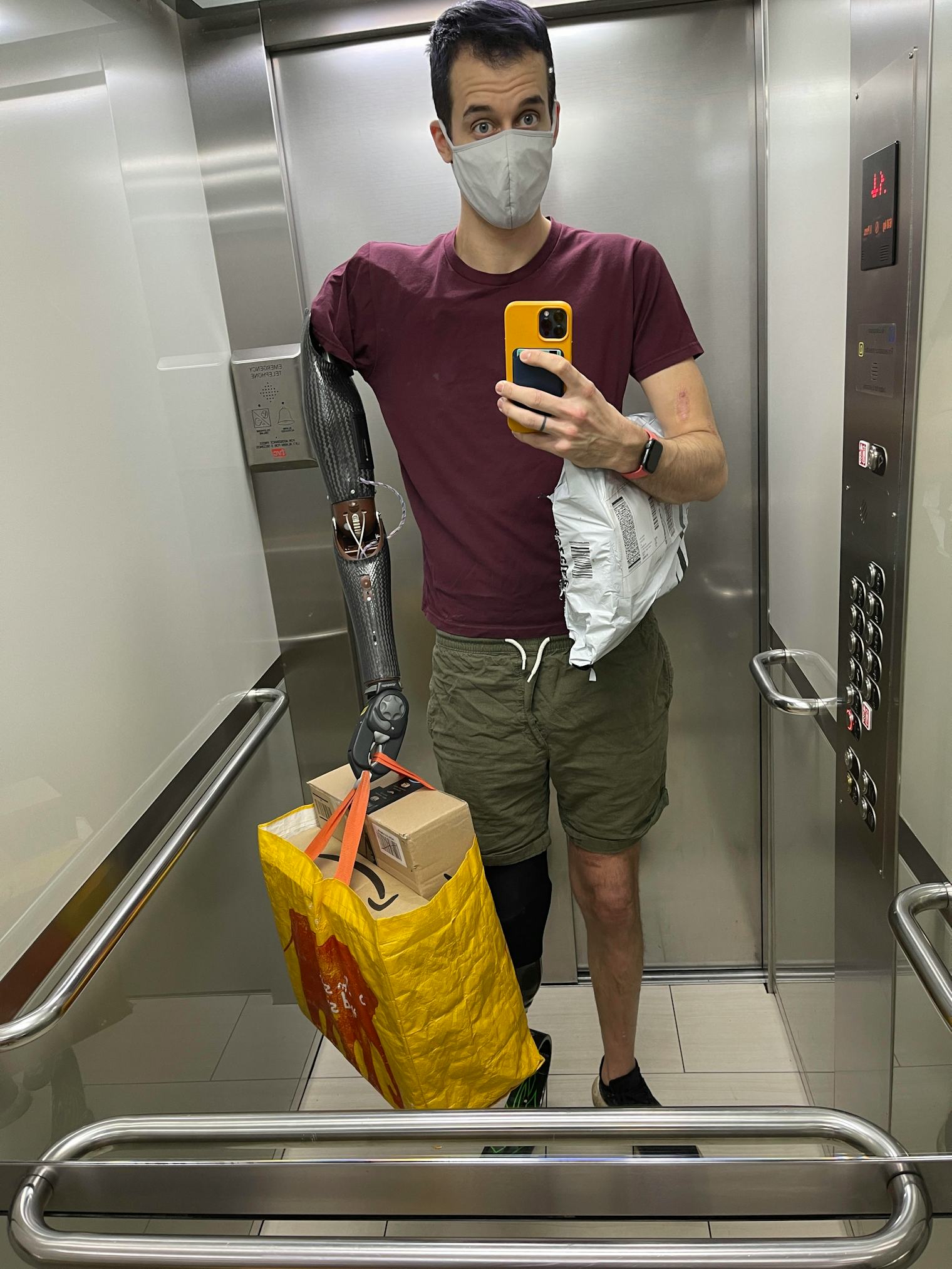 I have one of the most advanced prosthetic arms in the world — and I ...