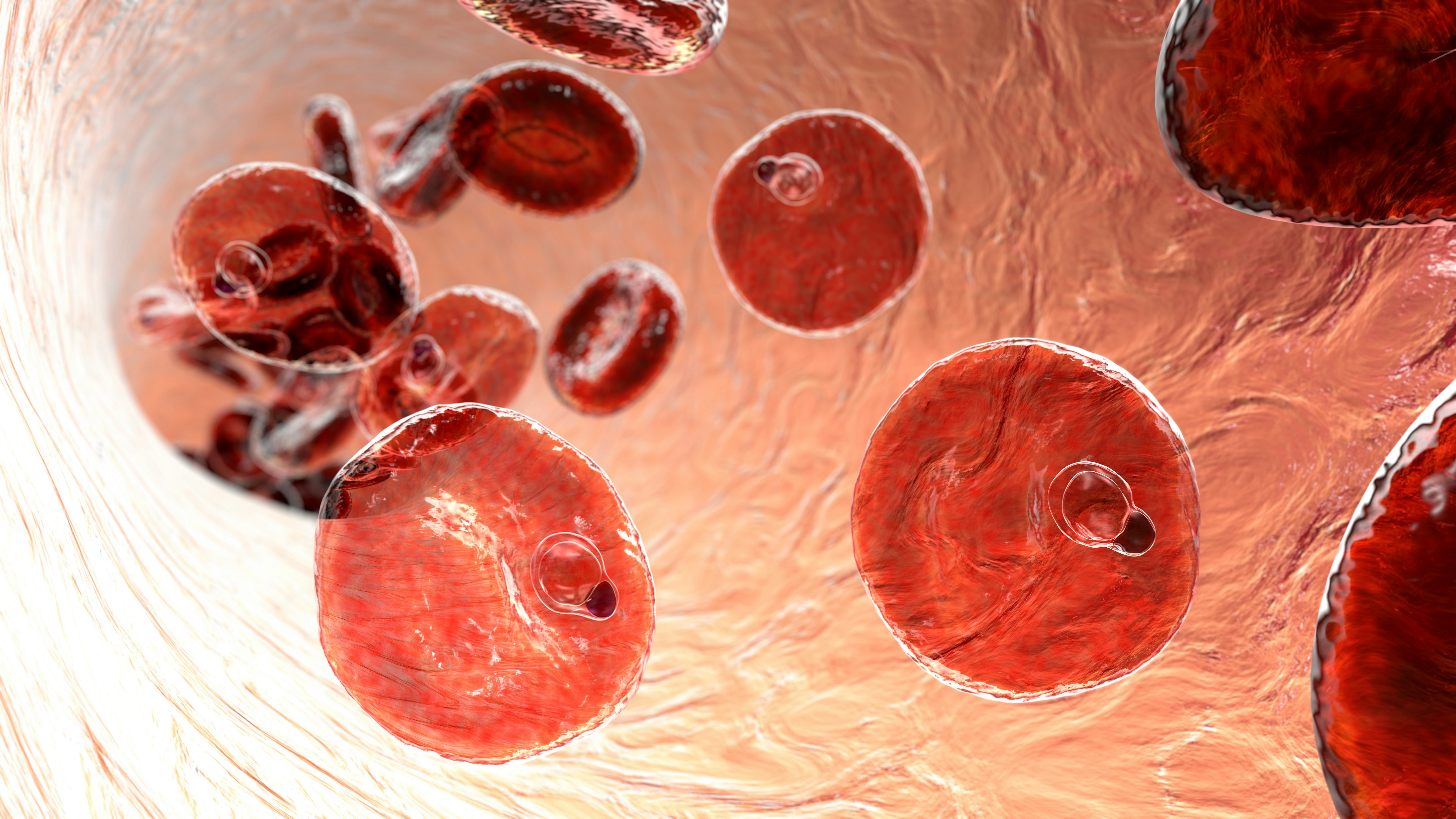 There's finally a breakthrough in the hunt for a malaria vaccine