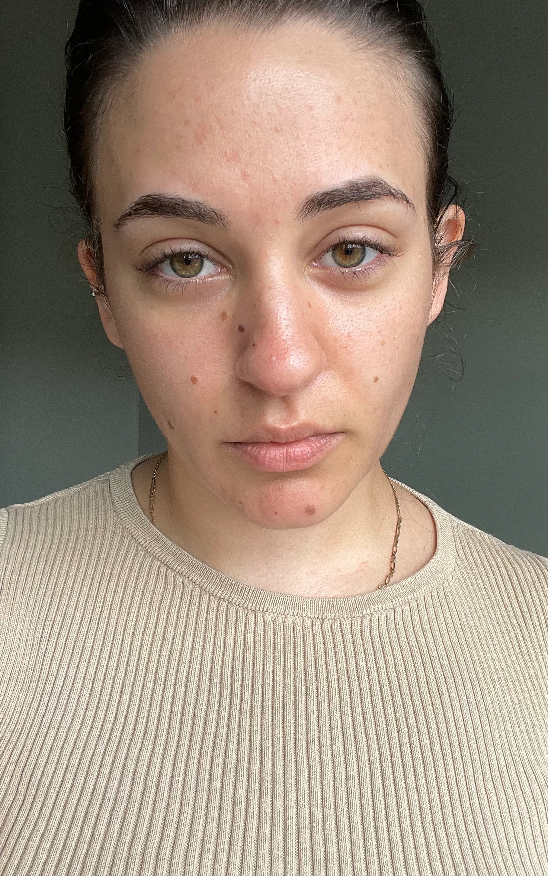 Superegg Eye & Cheek Mask Review: Here's How It Improved My Skin