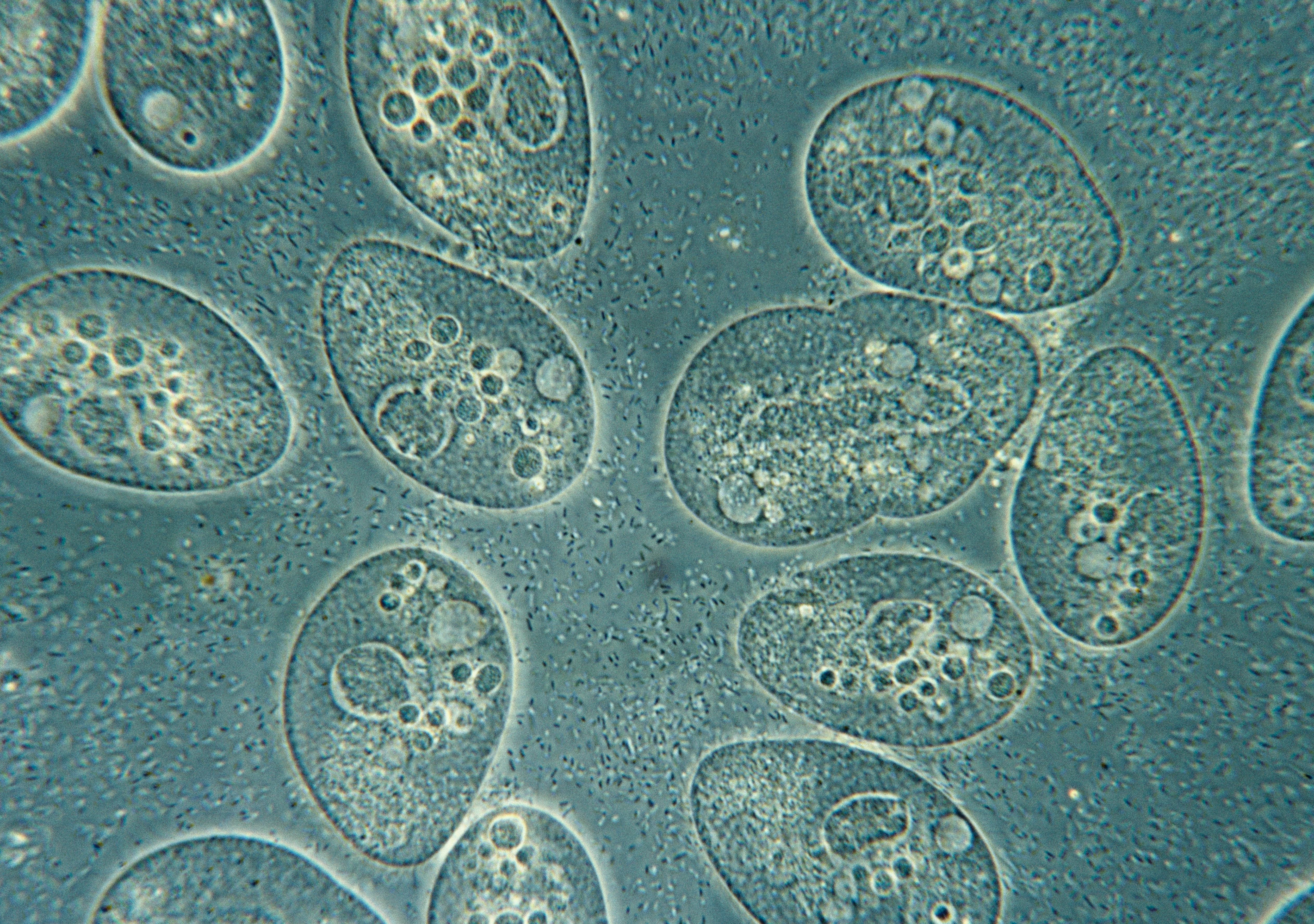 Watch: These artificial cells can clean up your drinking water