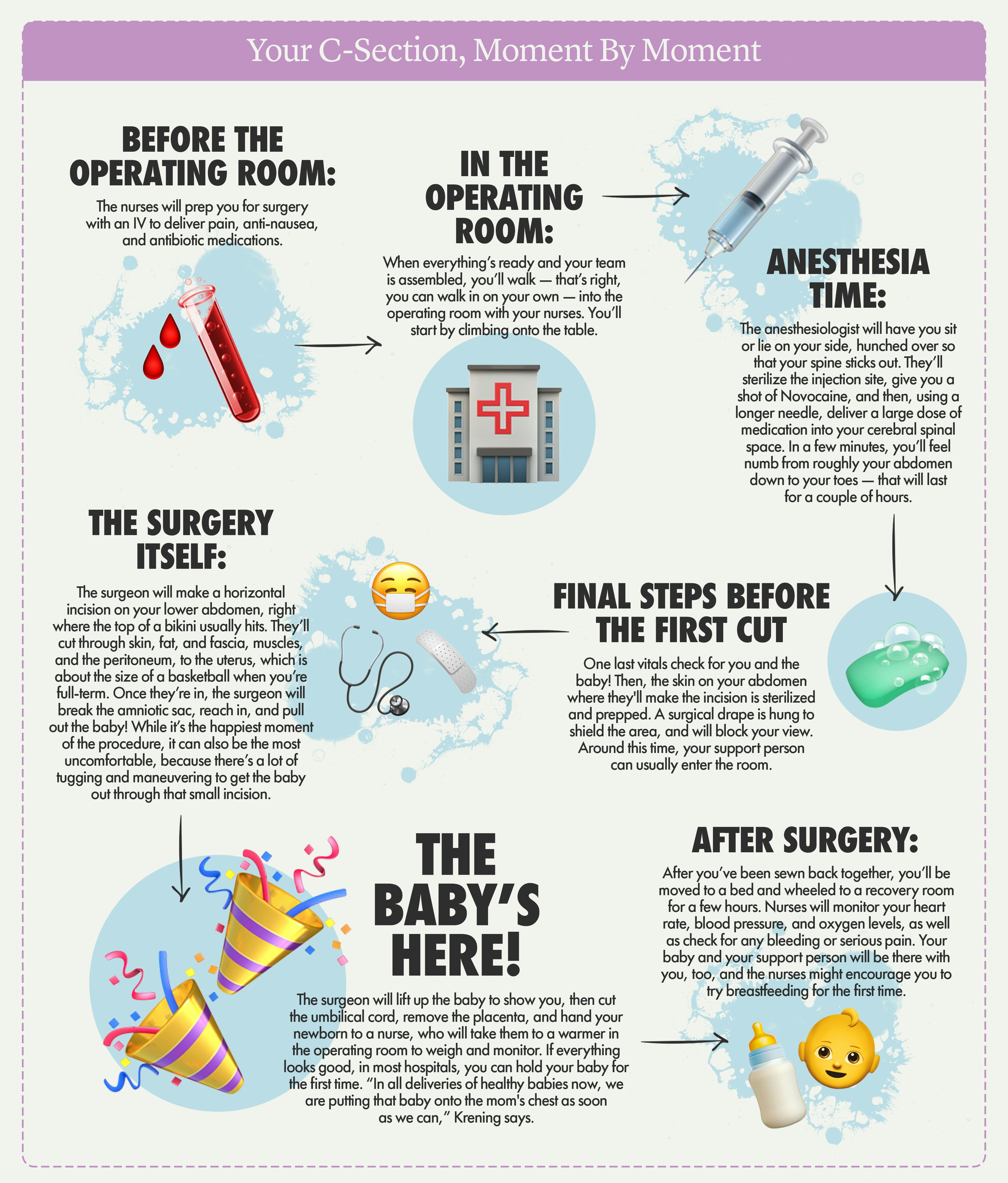 c section pre op