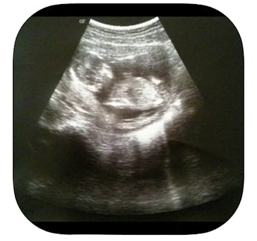 The Best Contraction Timers and How to Use Them