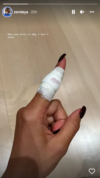 Zendaya Needed Stitches After A "Clumsy" Kitchen Accident
