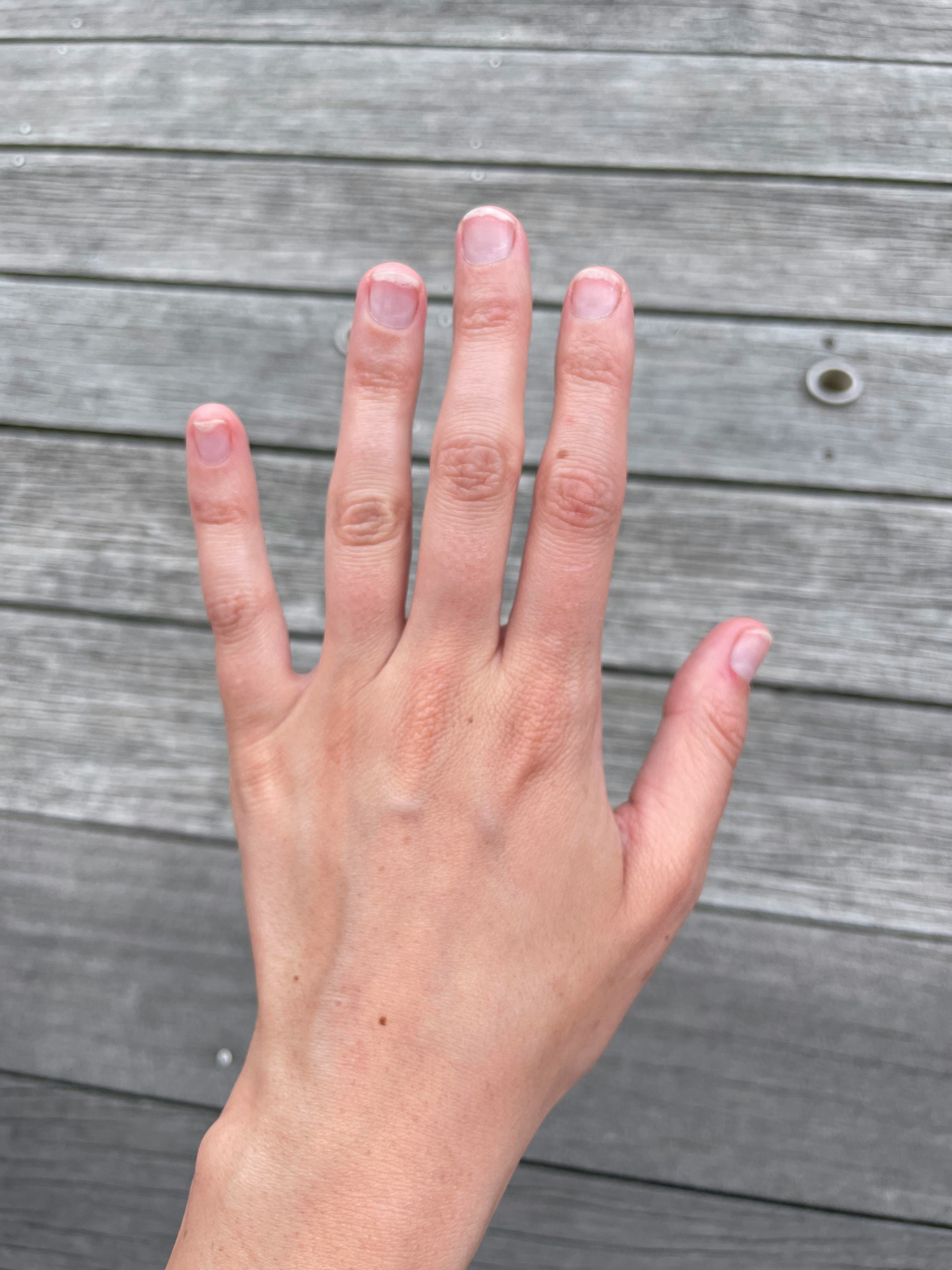 I Thought I Had Ugly Hands & Nails — Here's How I Embraced Them