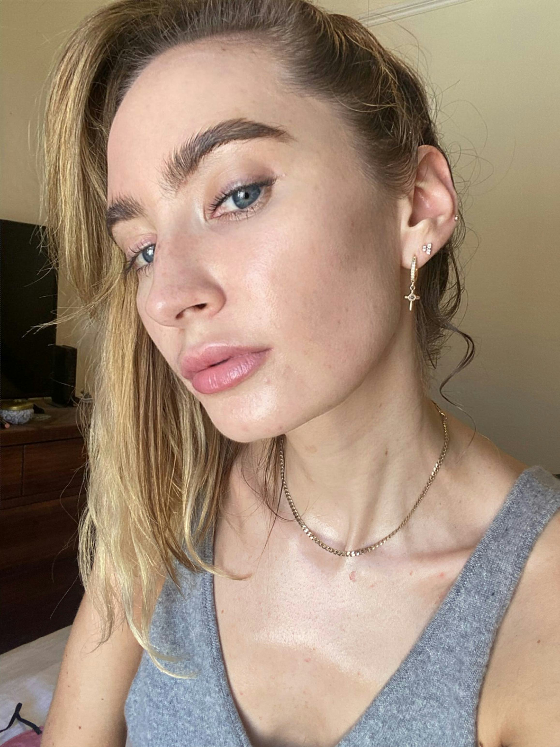 Waso Koshrice Acne Calming Spot Treatment Review Per A Beauty Writer