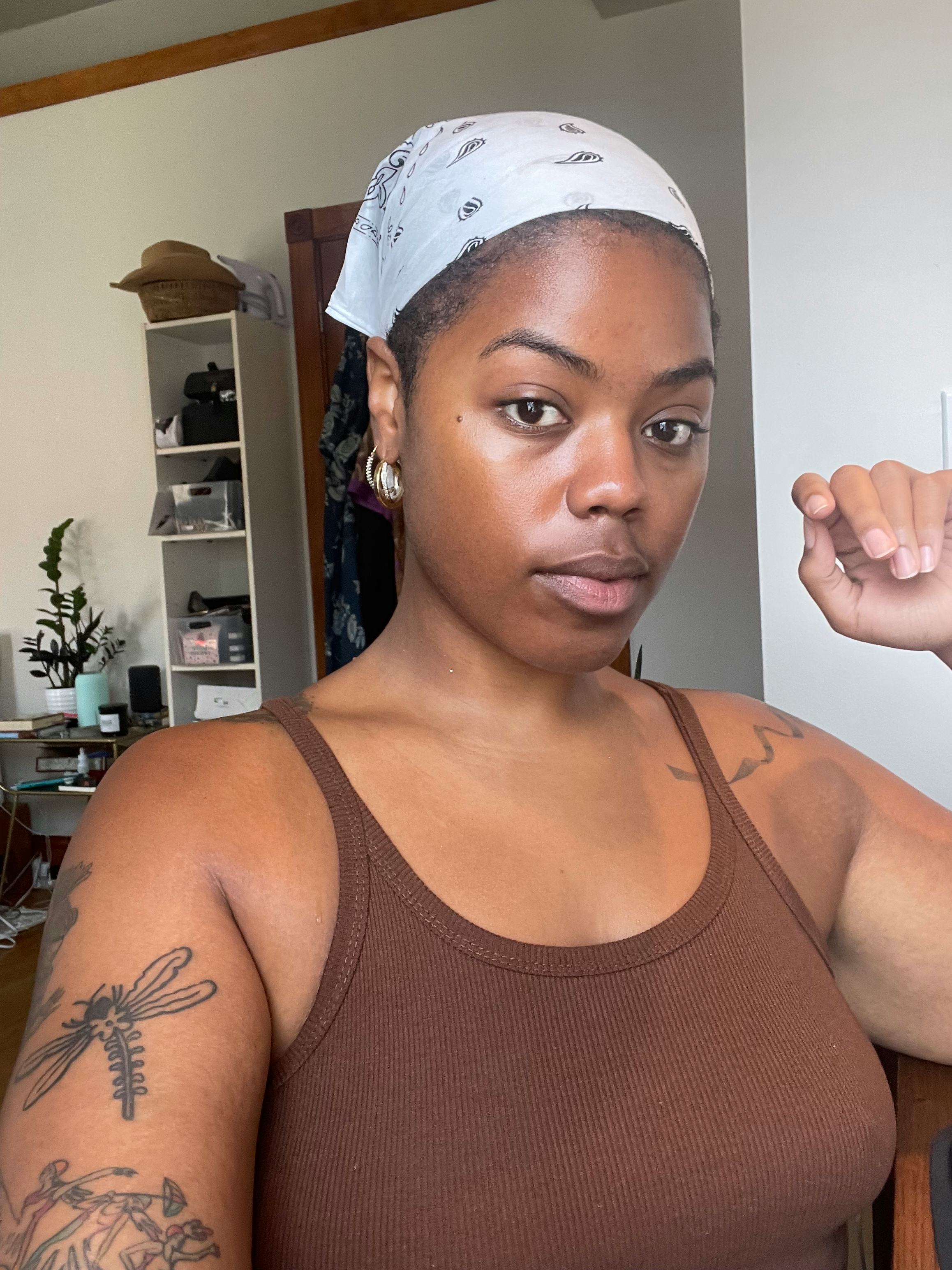 RHA Filler Guide: Cost, Before & After Photos, & More To Know