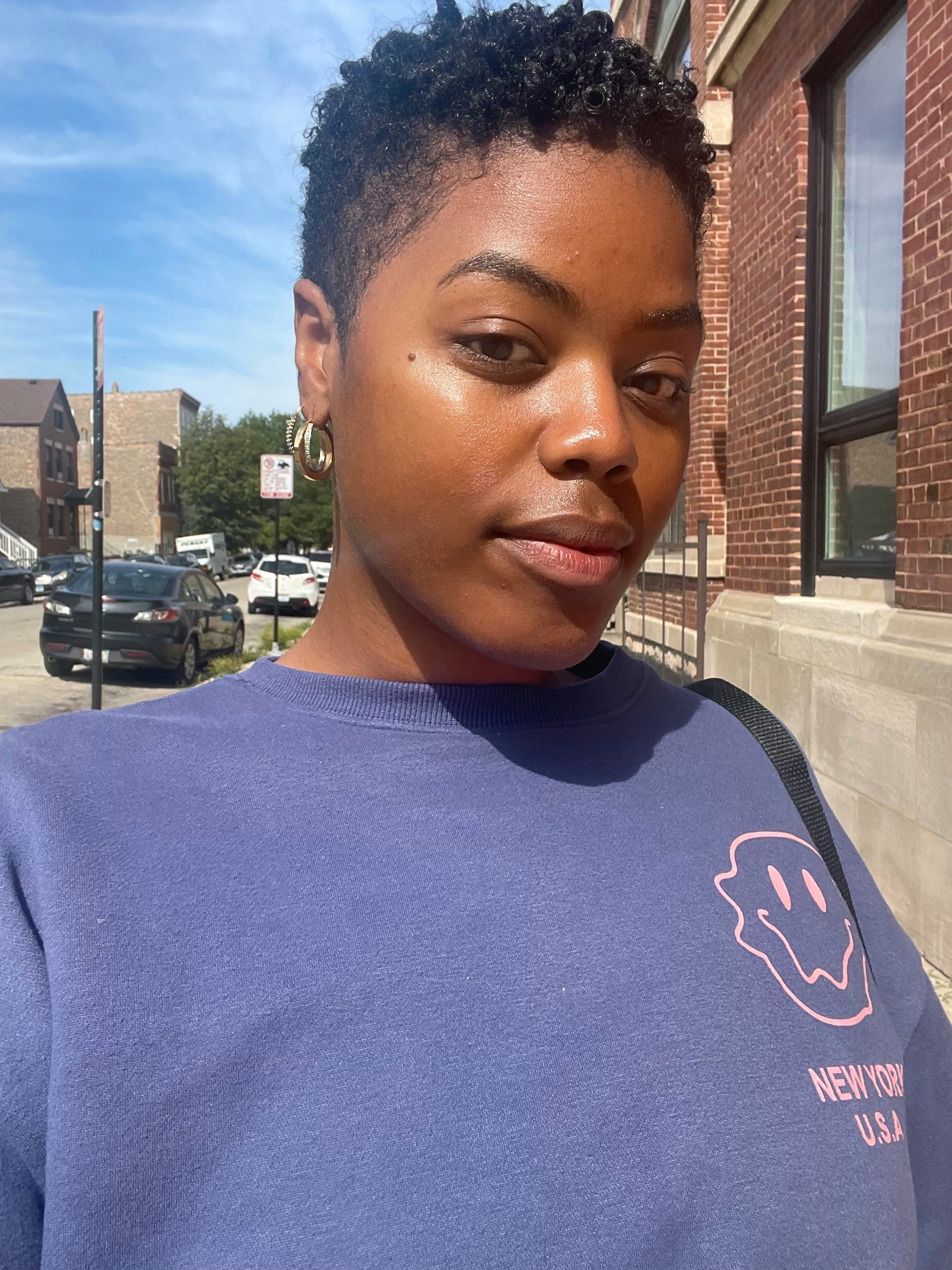 RHA Filler Guide: Cost, Before & After Photos, & More To Know