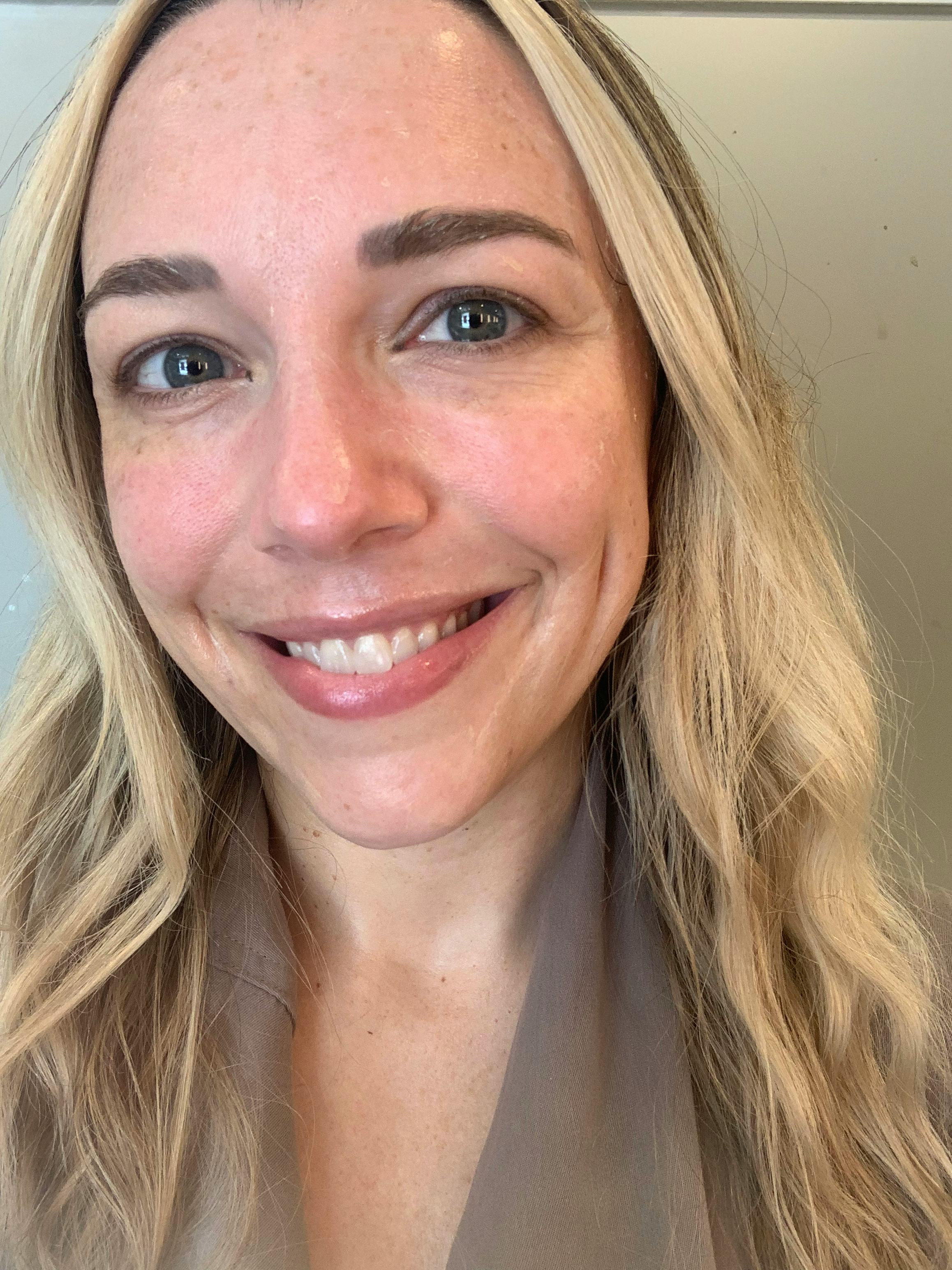 The HydraFacial Treatment Gave Me Glazed Donut Skin