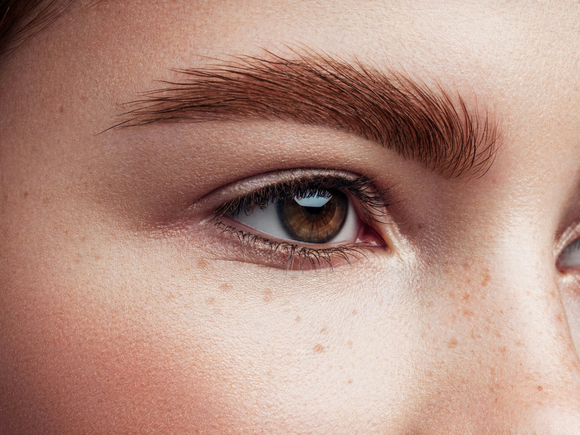 An Eyebrow Transplant Can Bring Thin, Sparse Brows Back To Life