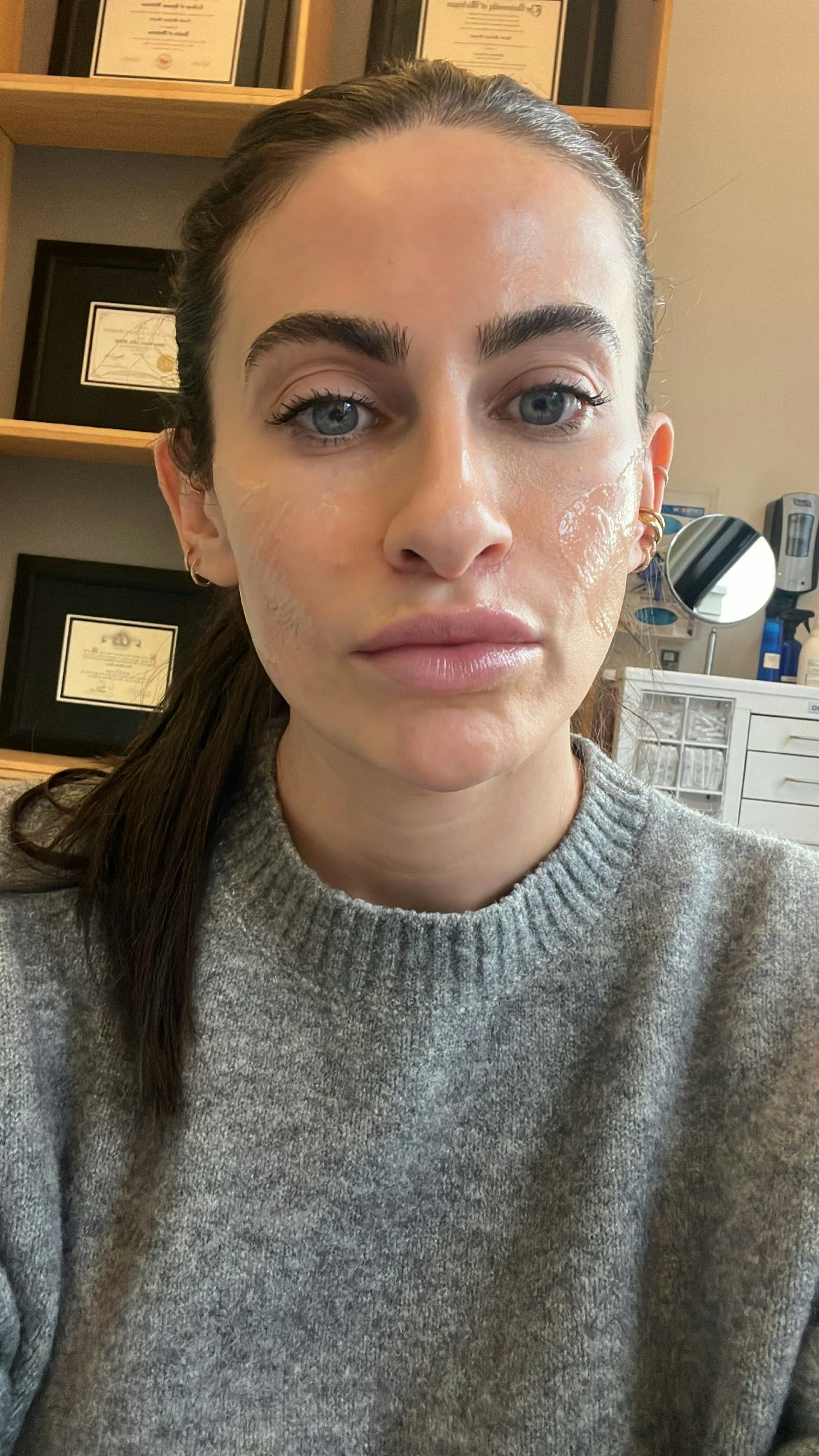 I Tried Skinvive, The Injectable Moisturizer That Smooths The Skin