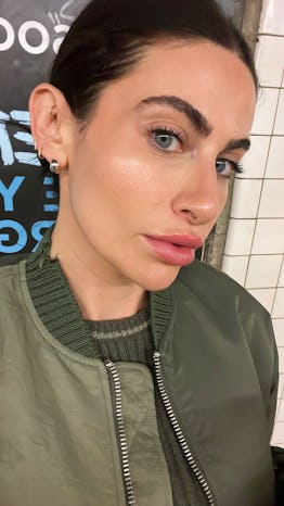 I Tried Skinvive, The Injectable Moisturizer That Smooths The Skin