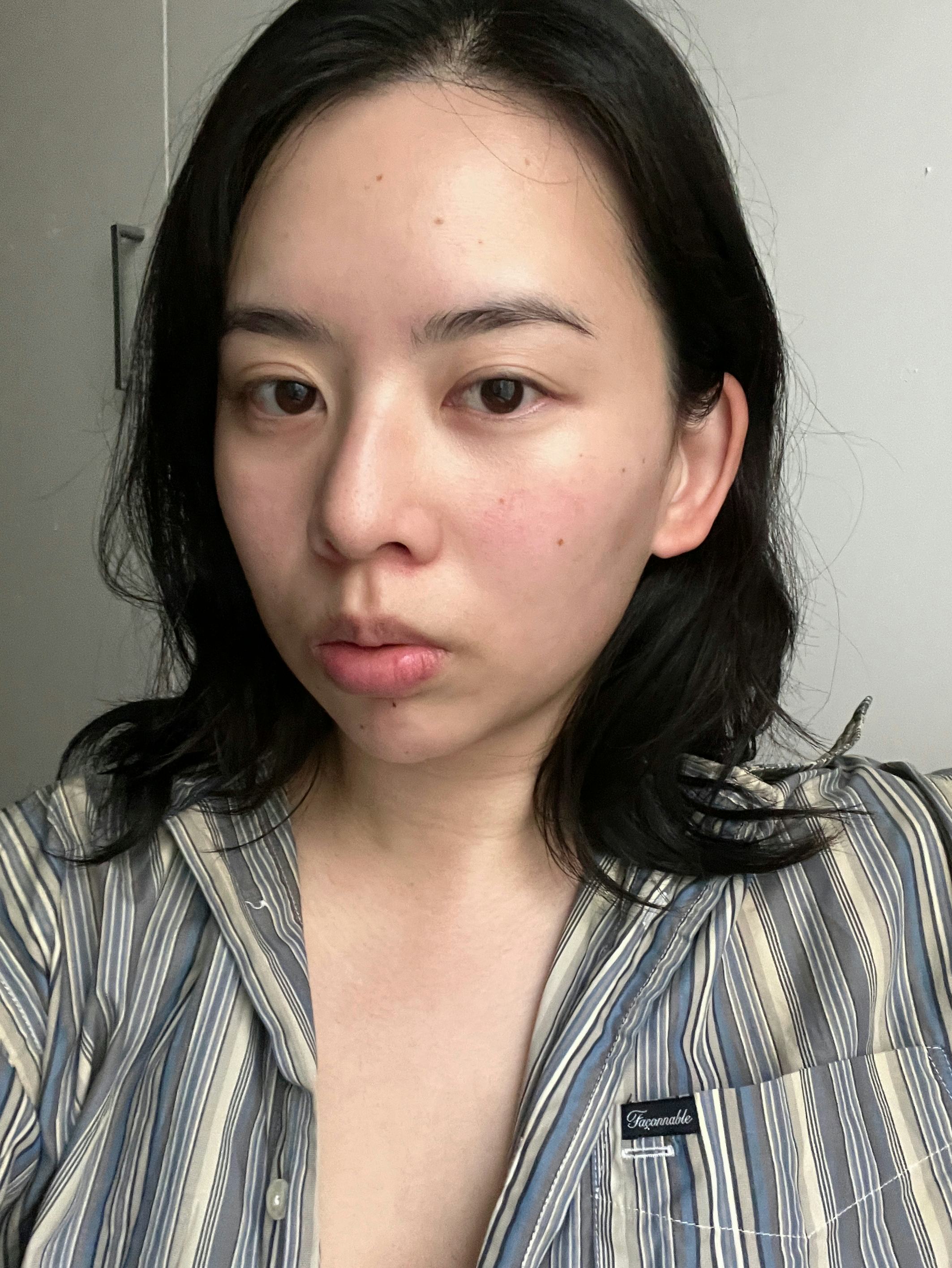 NIRA Pro Laser Review: An At-Home Skin Device That Smooths Fine Lines ...