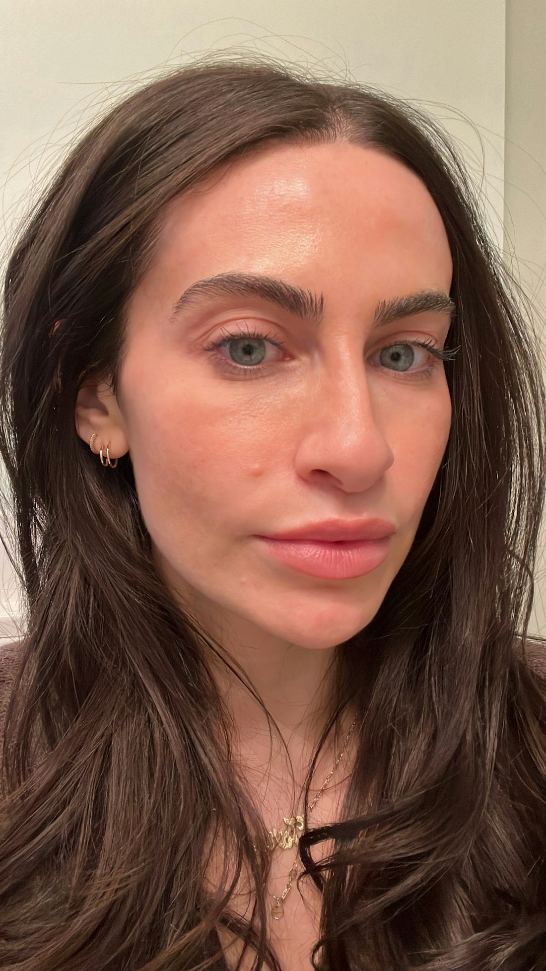 Daxxify Is The Longer-Lasting Botox Alternative You Need To Know