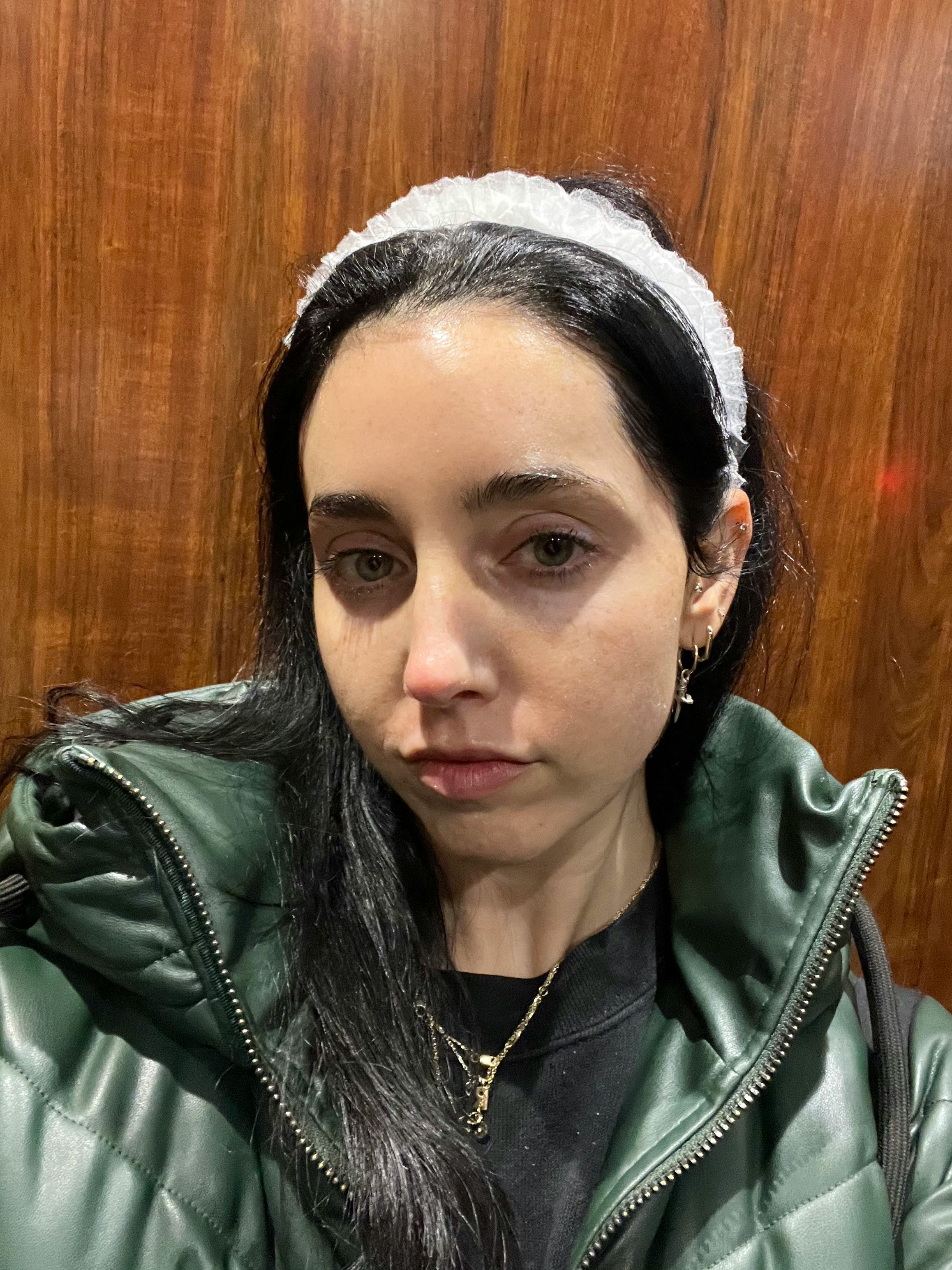 A Sofwave Review: The Benefits & Results Of The Buzzy Skin Treatment