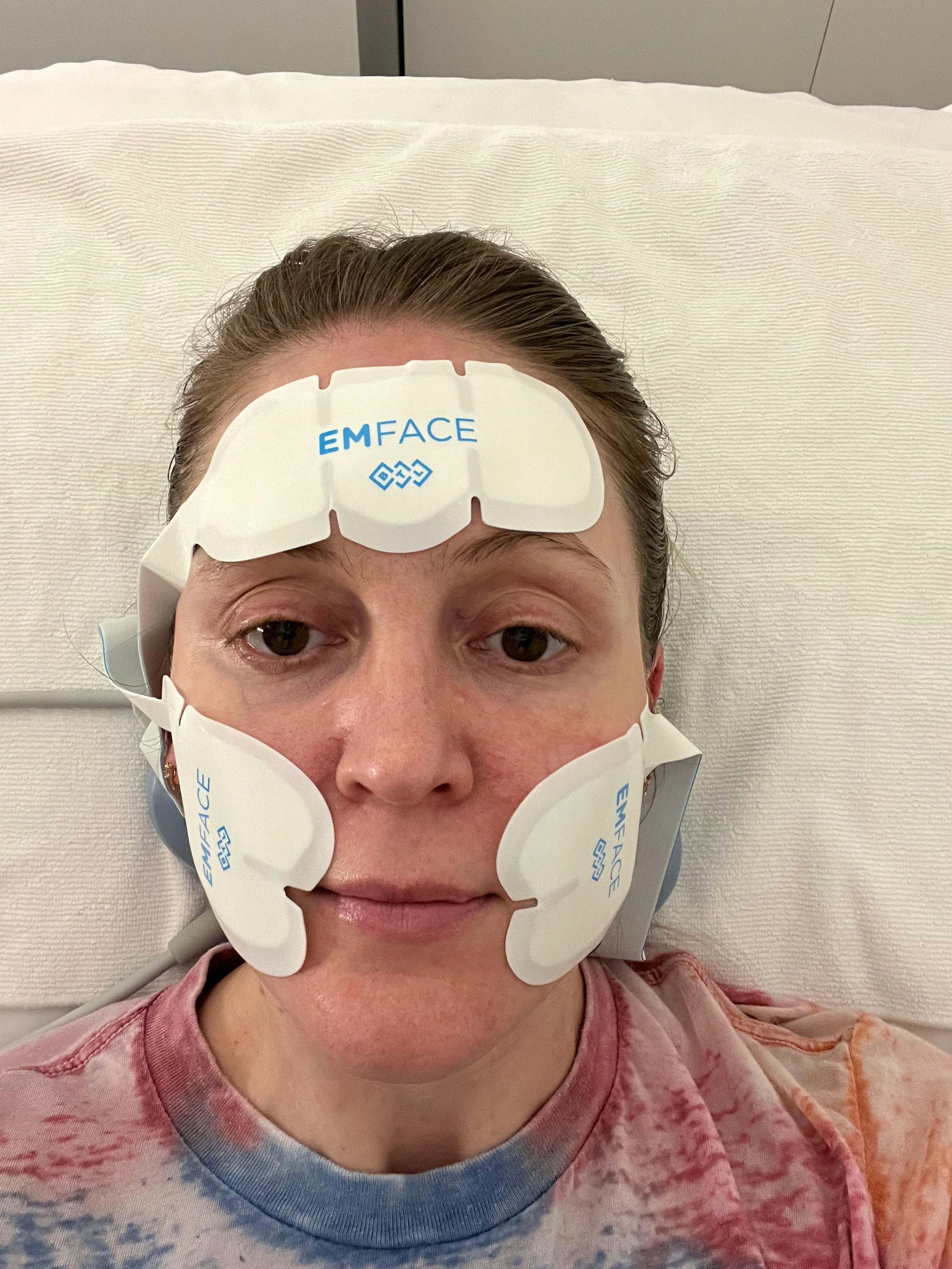 The Emface Treatment Is The Ultimate Alternative To Botox & Filler