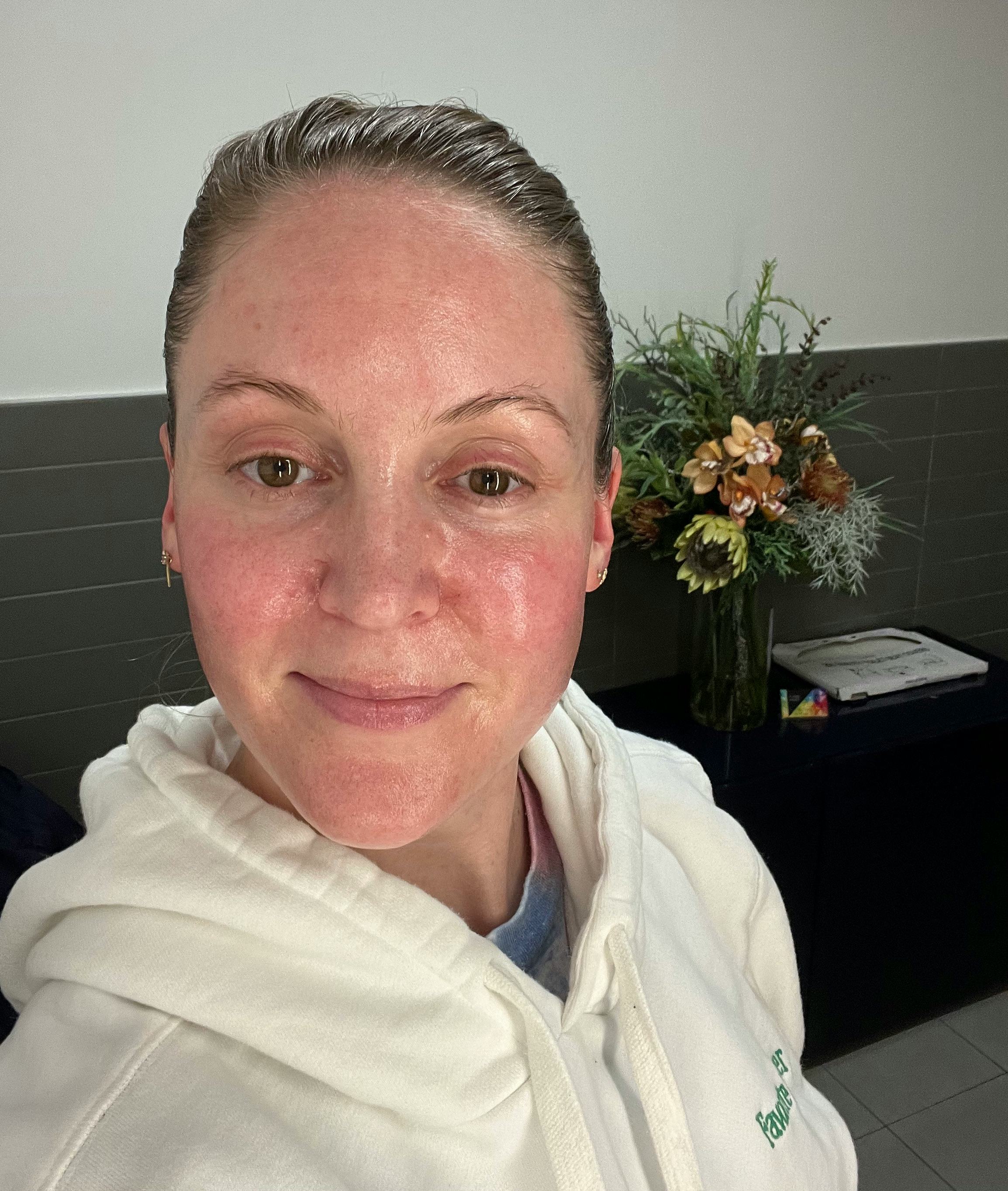 The Emface Treatment Is The Ultimate Alternative To Botox & Filler