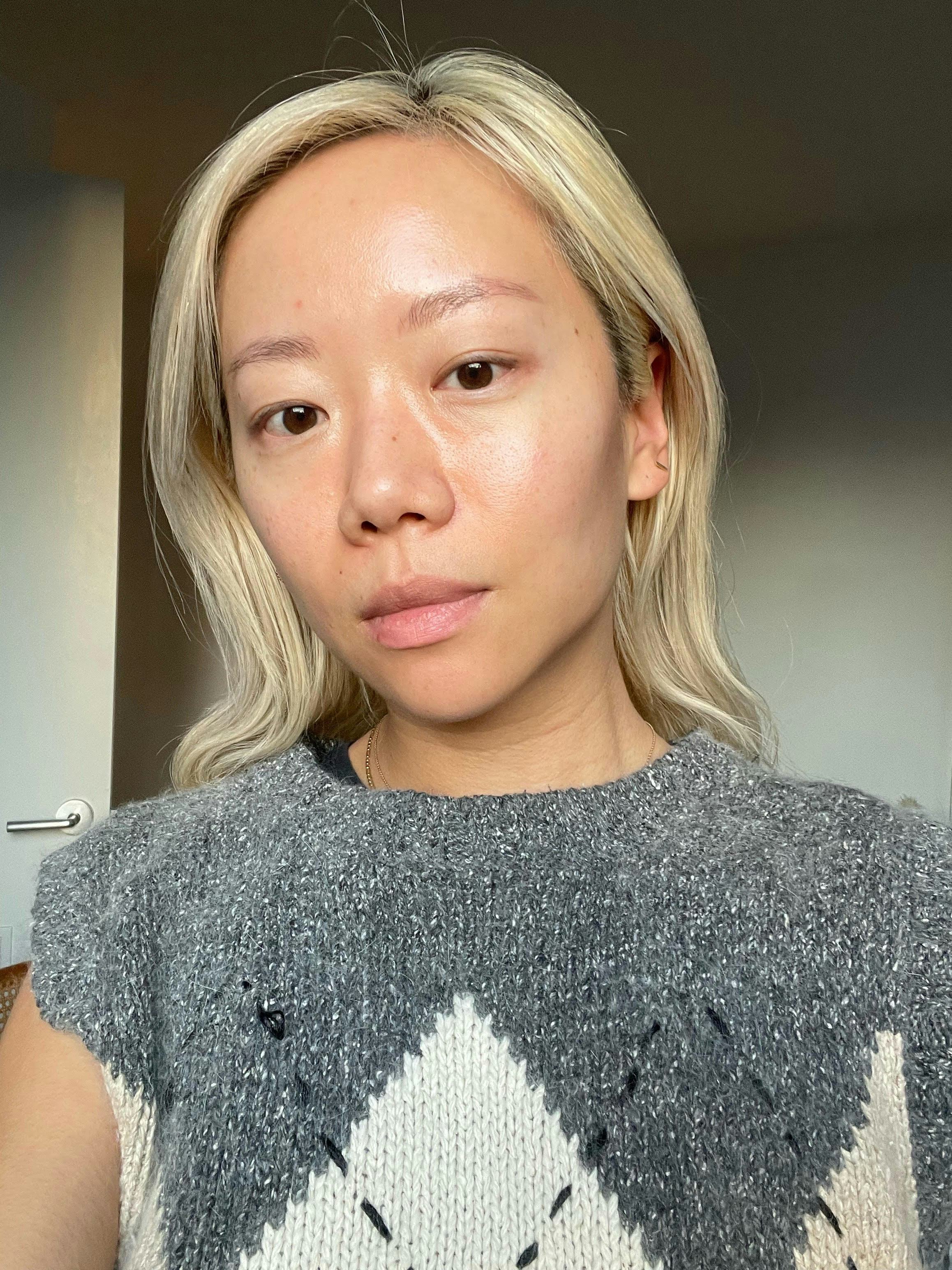 Augustinus Bader The Retinol Serum Review: A Gentle Treatment That ...