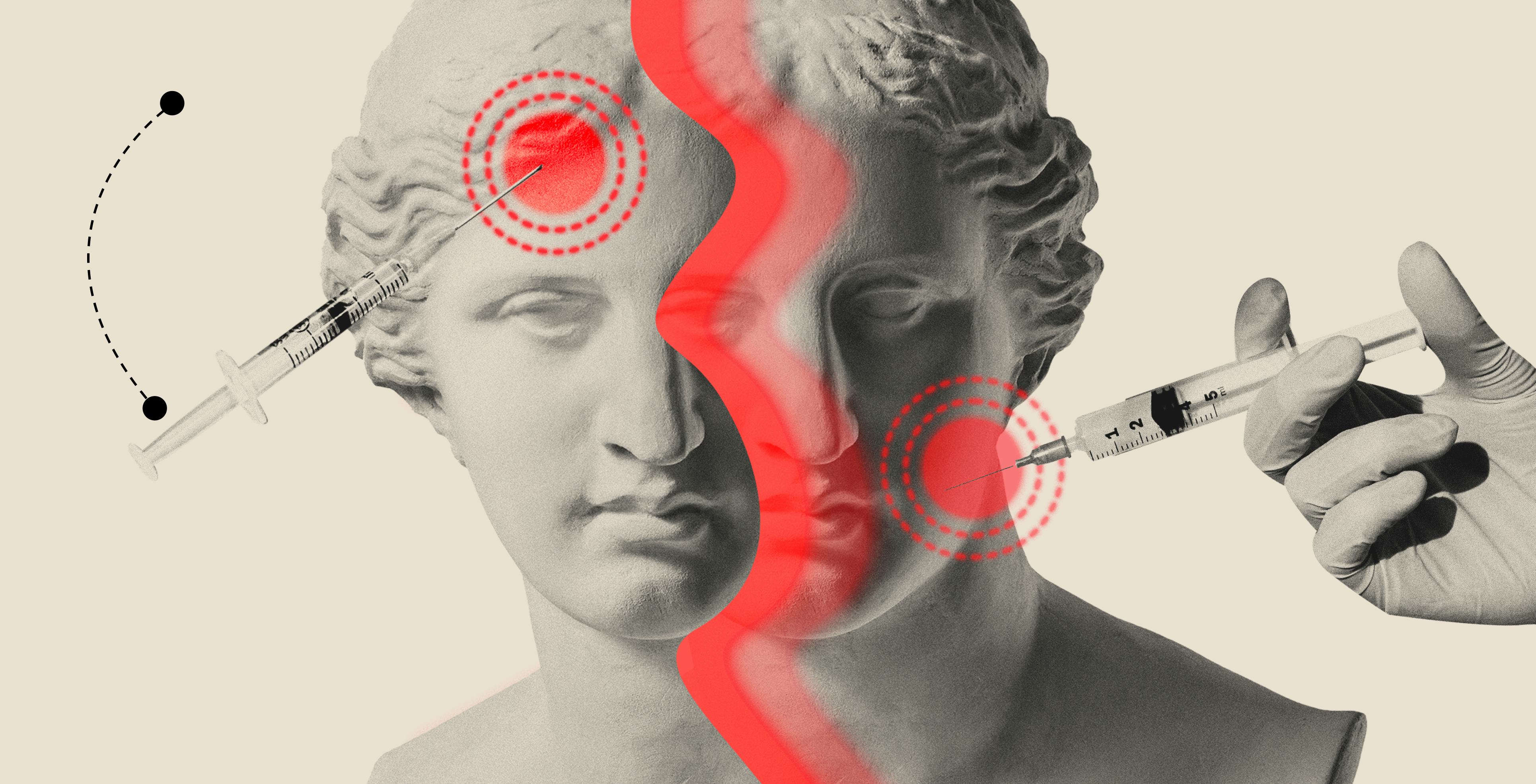 Facial Fillers & Botox Gone Wrong: How To Deal If It Happens To You