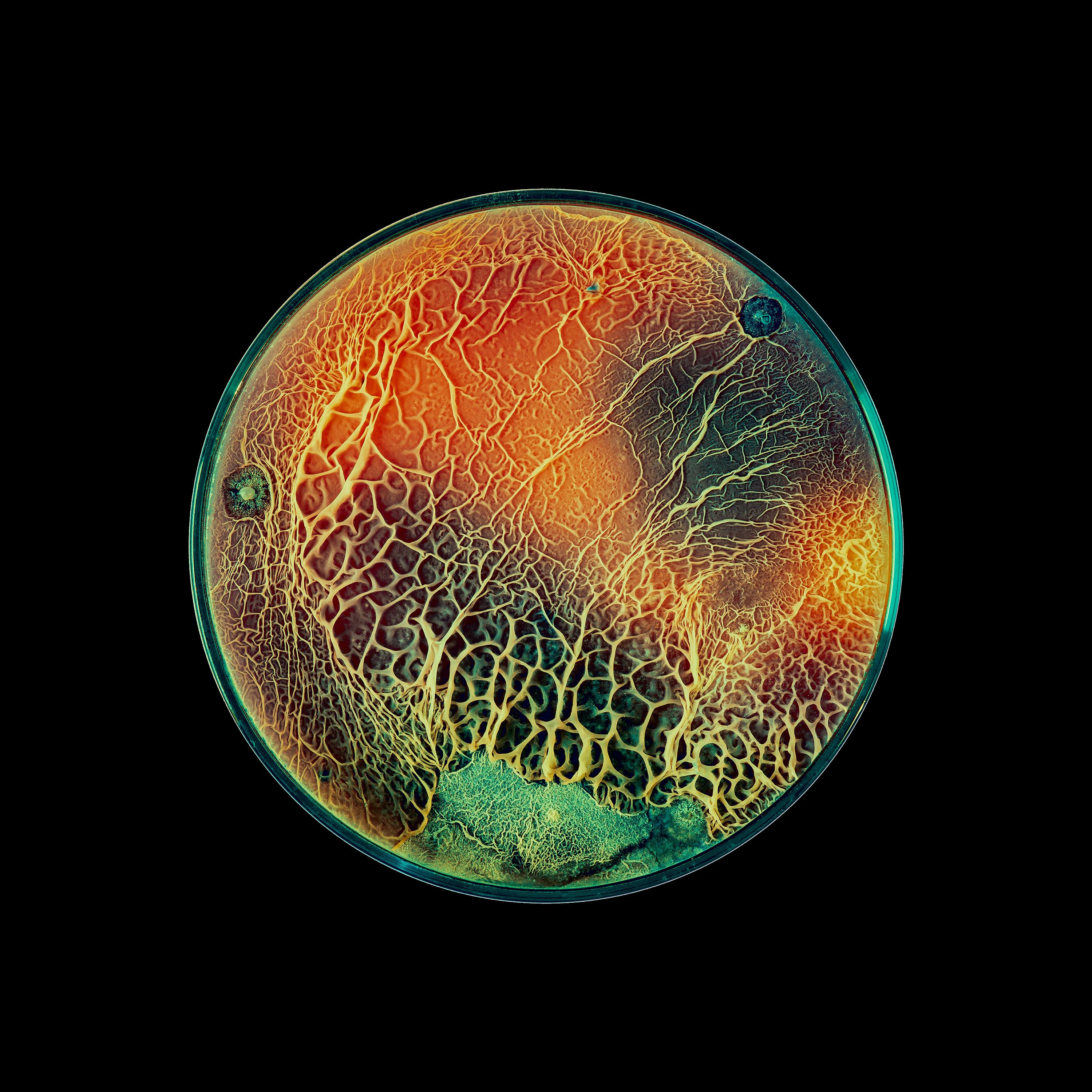 Inside the Race To Create the World’s First Anti-Fungal Vaccine