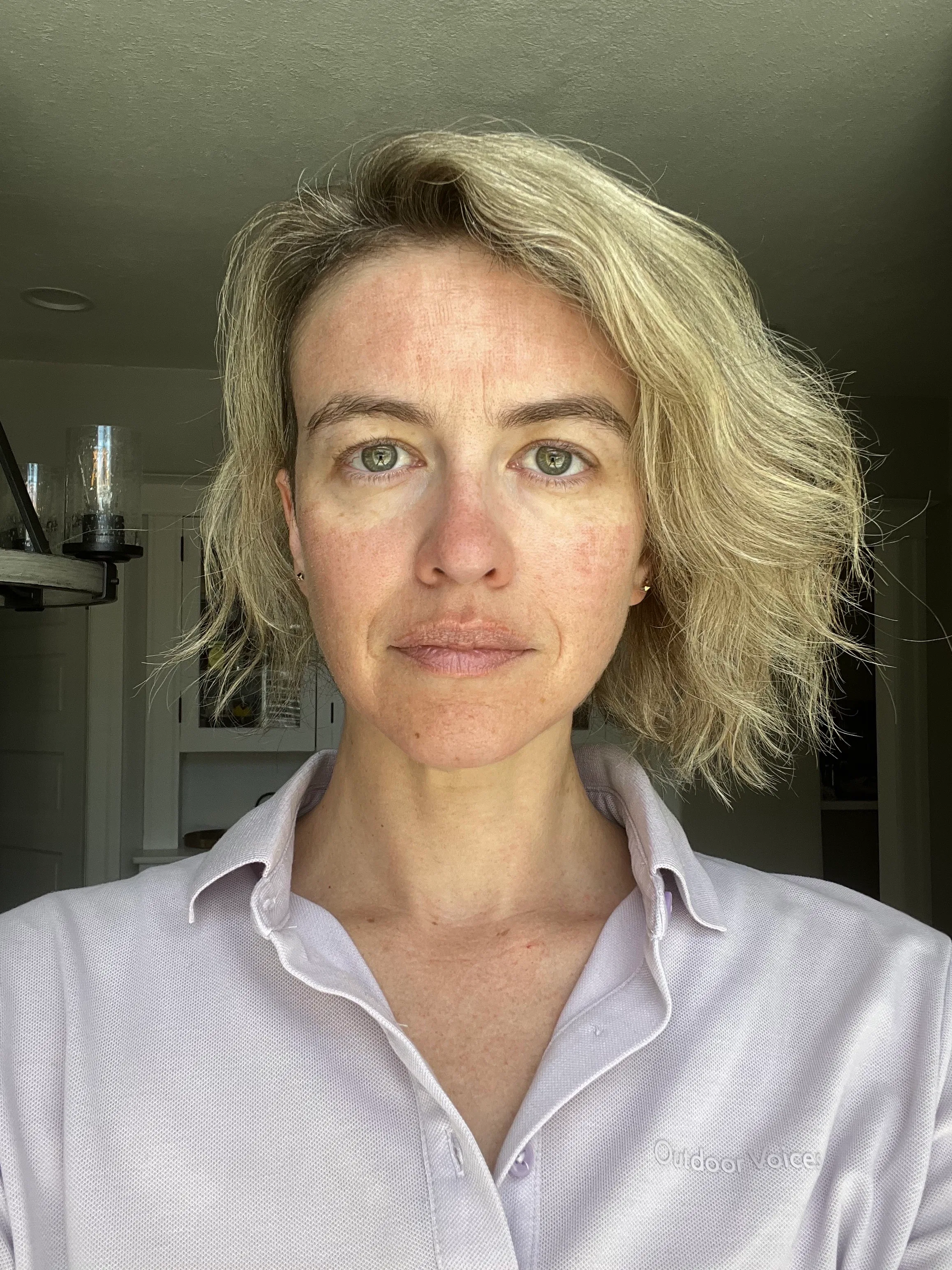 Skin Laundry The Fixer Review: A Needle-Free Botox Alternative For ...