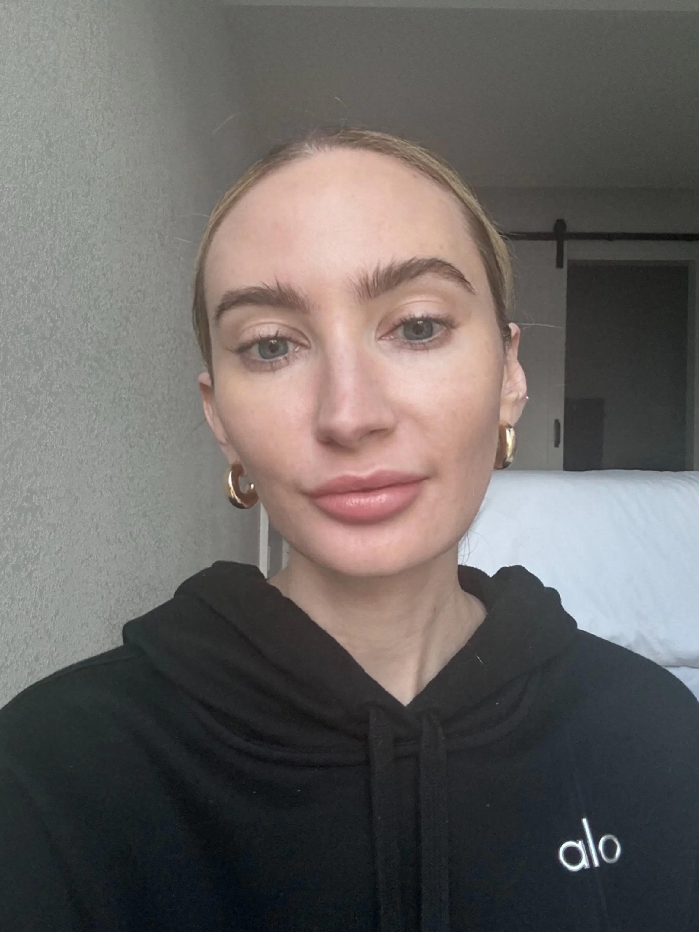 PRX Derm Perfexion Gave Me Glowing Skin In Less Than 30 Minutes