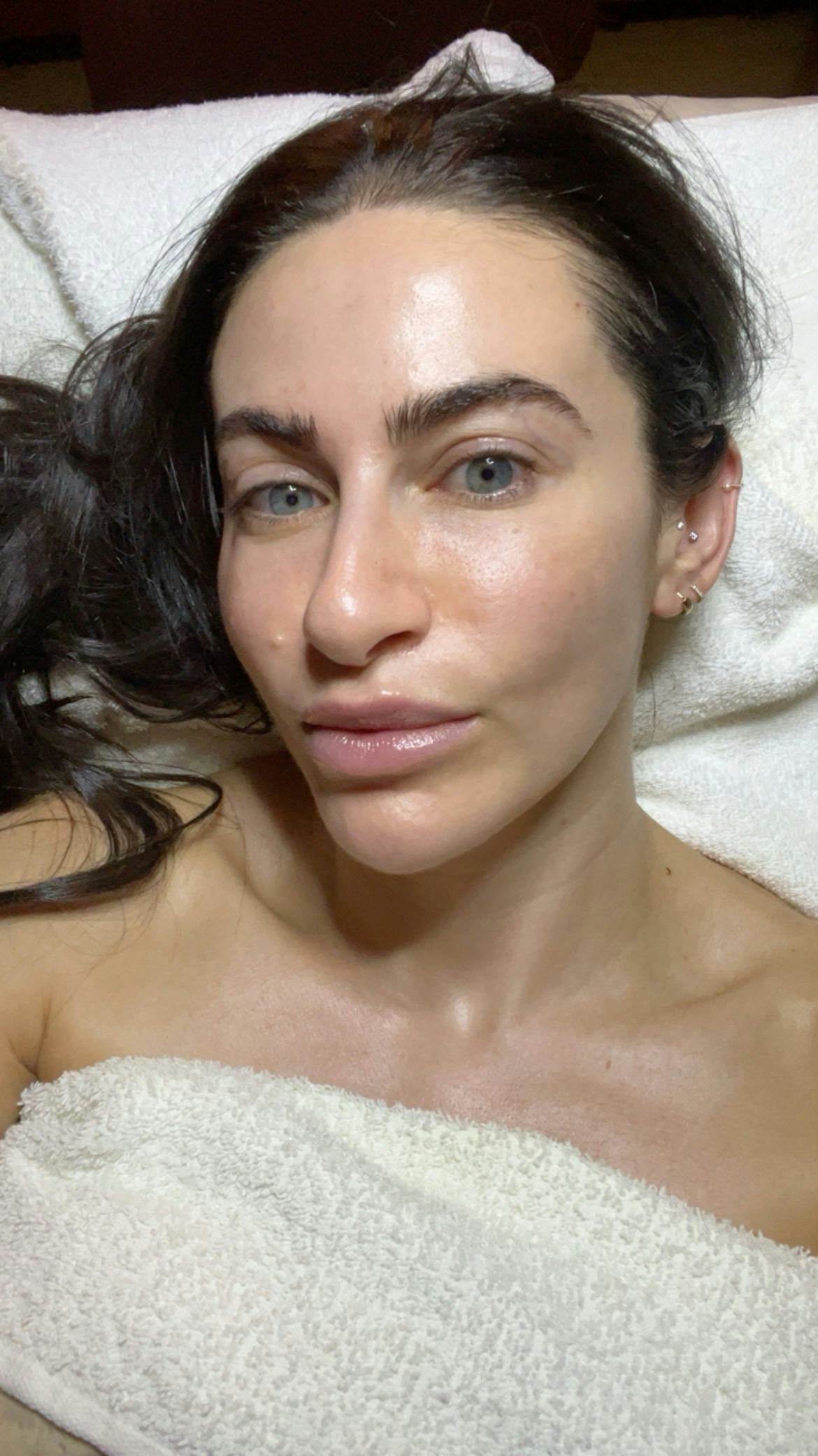 HydraFacial’s Hydralock HA Booster Gave Me An Instant Glow-Up